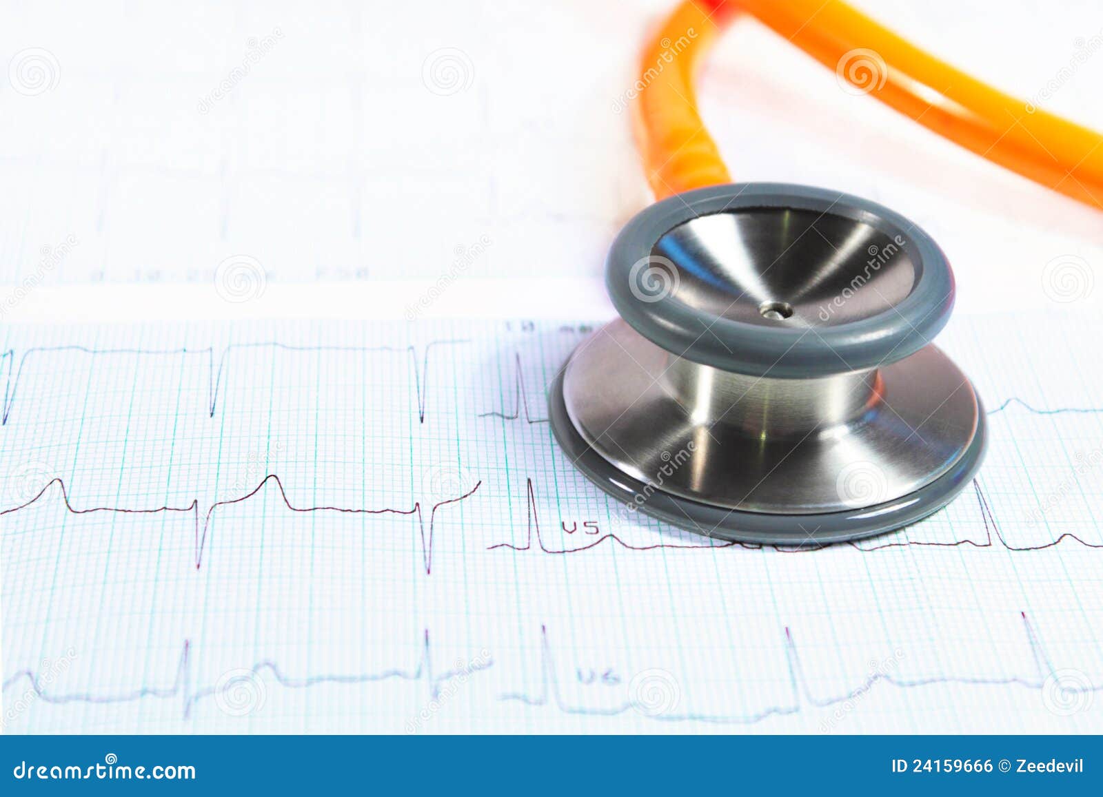 Stethoscope on Electrocardiogram - ECG Stock Photo - Image of hearth ...