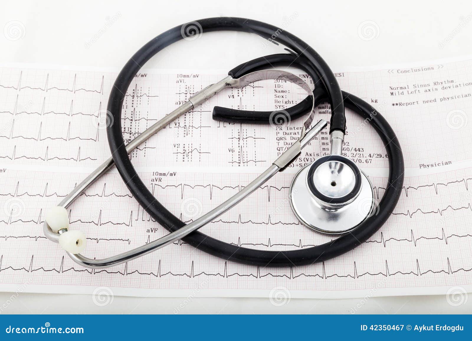 Stethoscope on an Electrocardiogram (ECG) Chart Stock Image - Image of ...