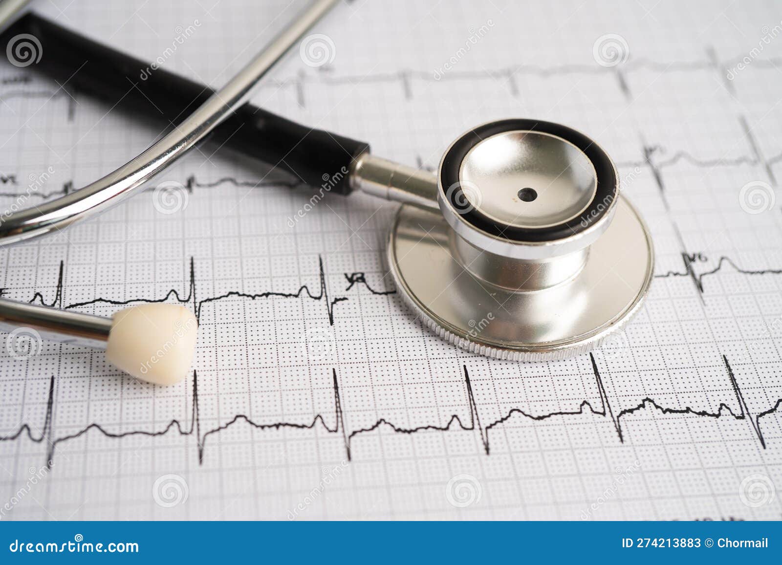 Stethoscope on Electrocardiogram ECG, Heart Wave, Heart Attack ...
