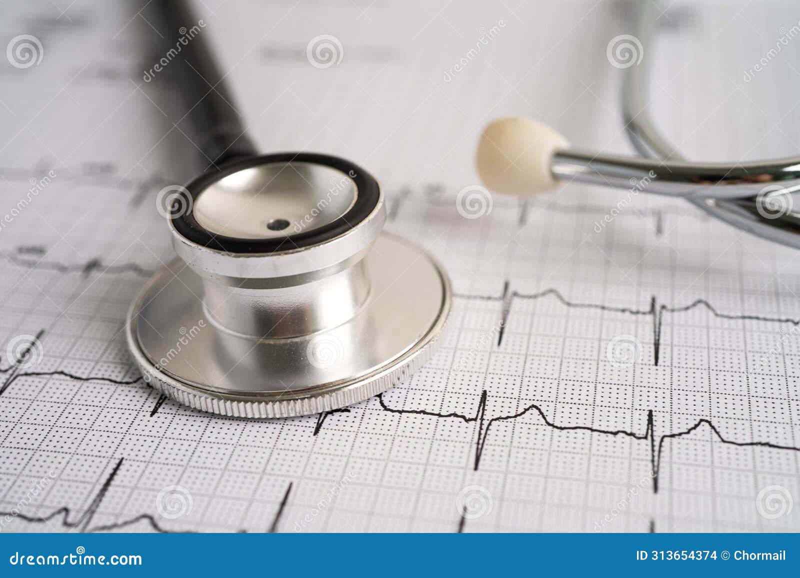 Stethoscope on Electrocardiogram ECG, Heart Wave, Heart Attack ...