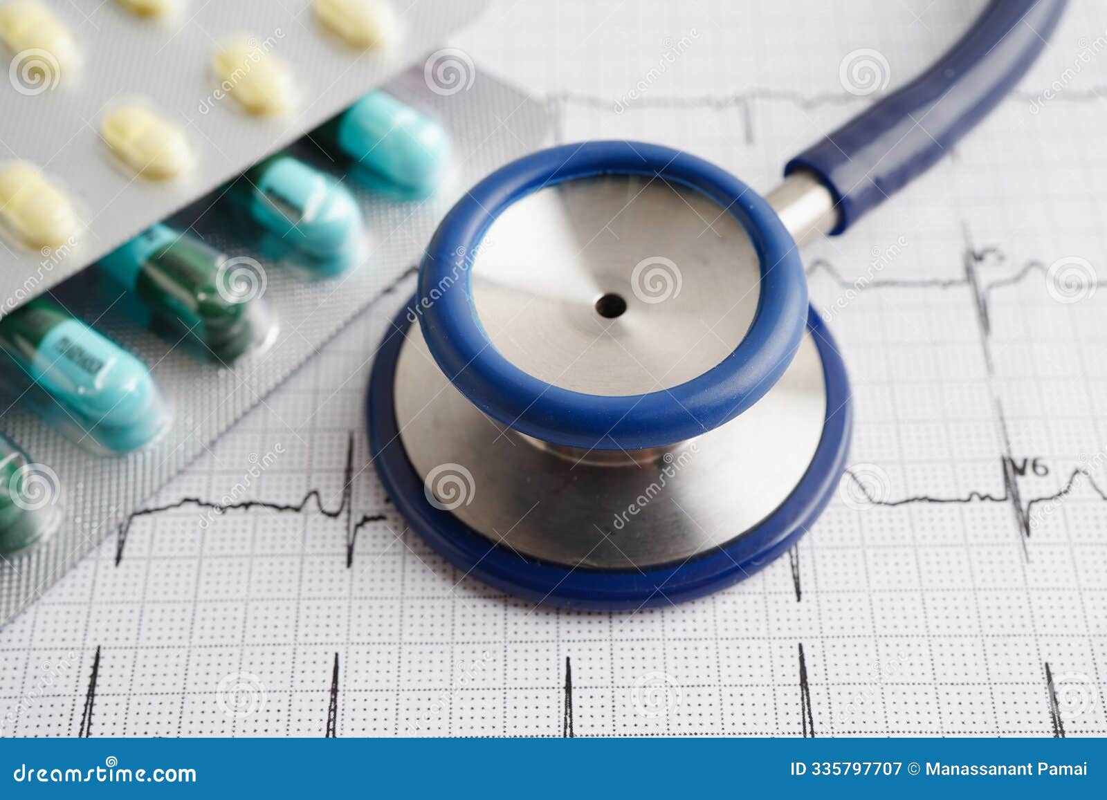 Stethoscope on Electrocardiogram (ECG), Heart Wave, Heart Attack ...