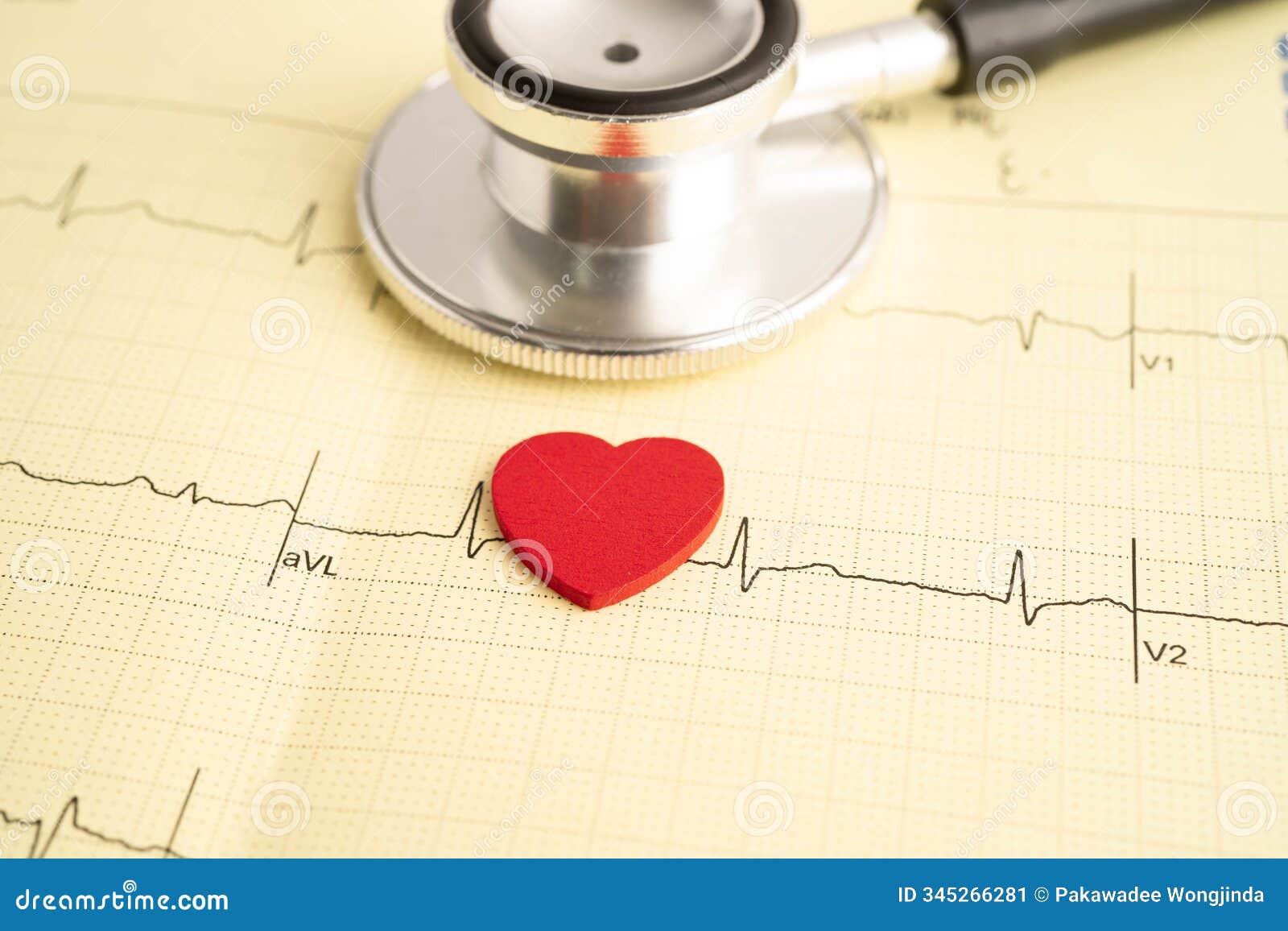 Stethoscope on Electrocardiogram ECG, Heart Wave, Heart Attack ...