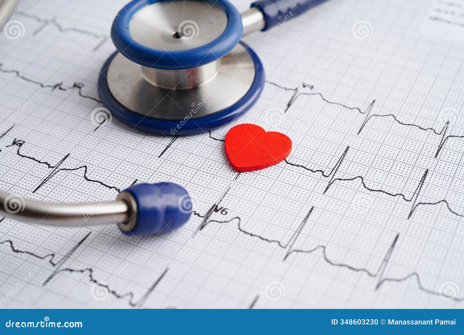 Stethoscope on Electrocardiogram (ECG), Heart Wave, Heart Attack ...