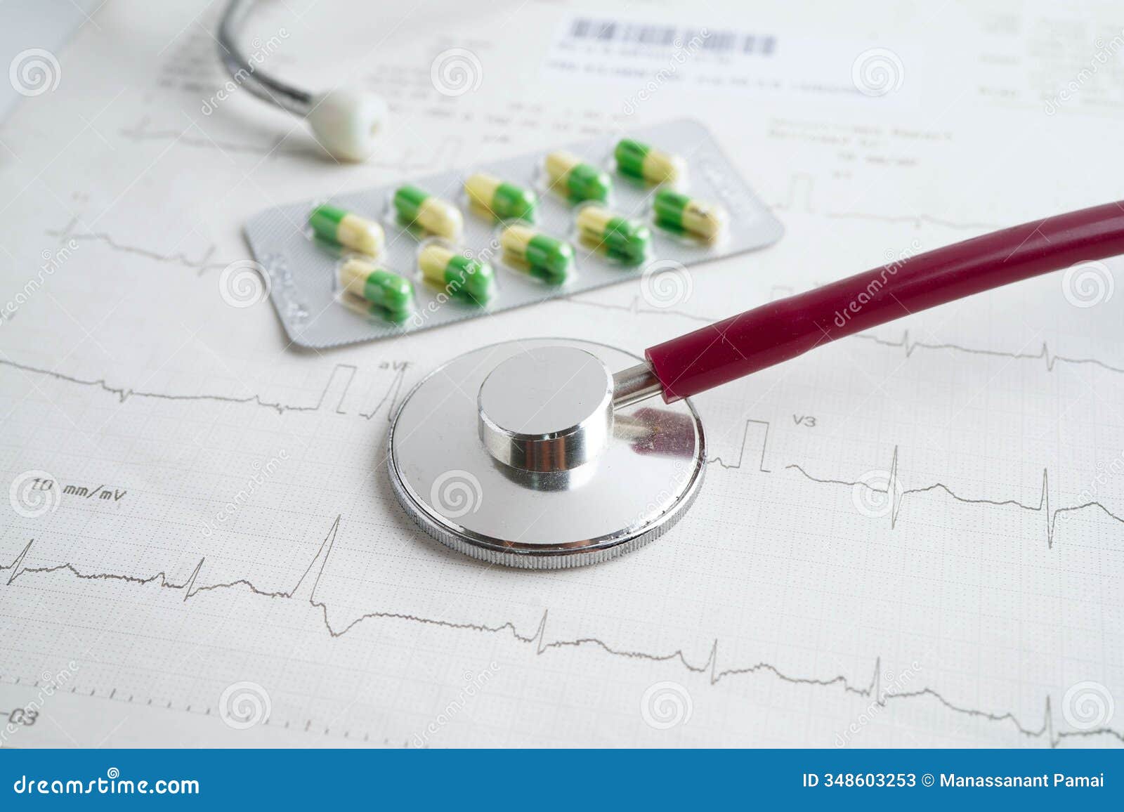 Stethoscope on Electrocardiogram (ECG), Heart Wave, Heart Attack ...