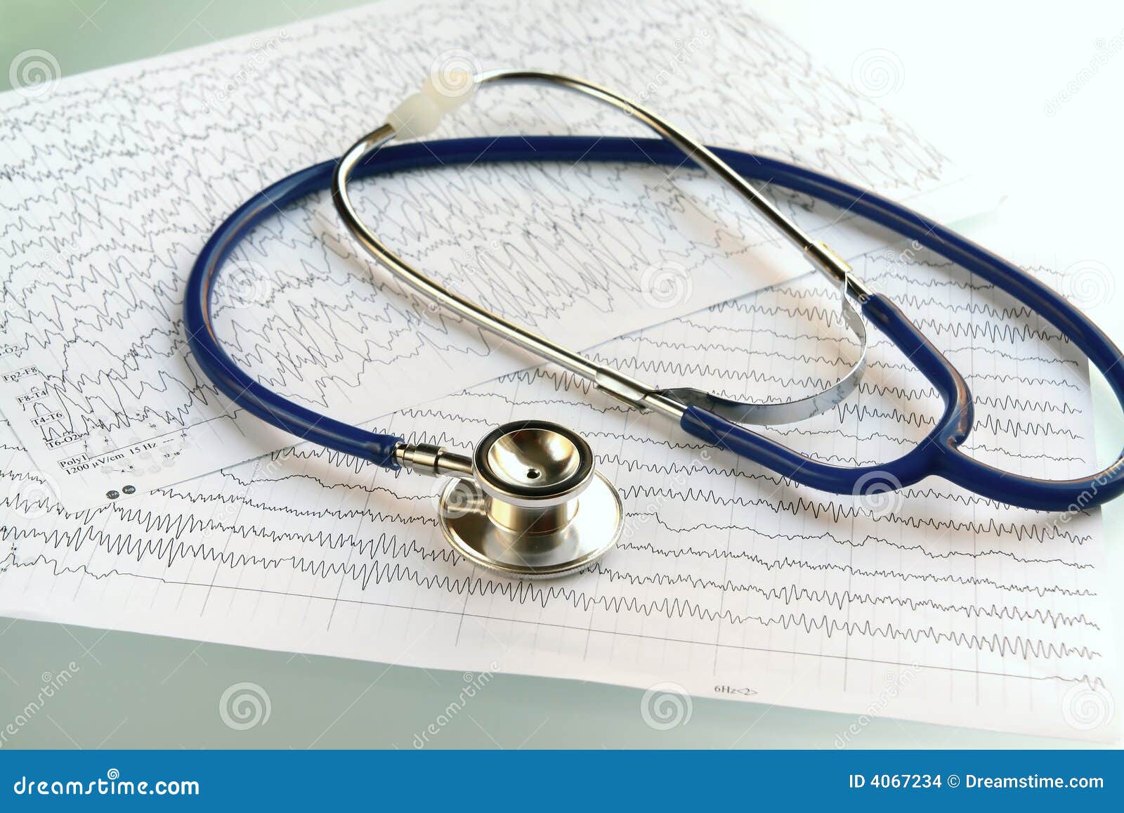 Stethoscope and graph stock photo. Image of profession - 4067234