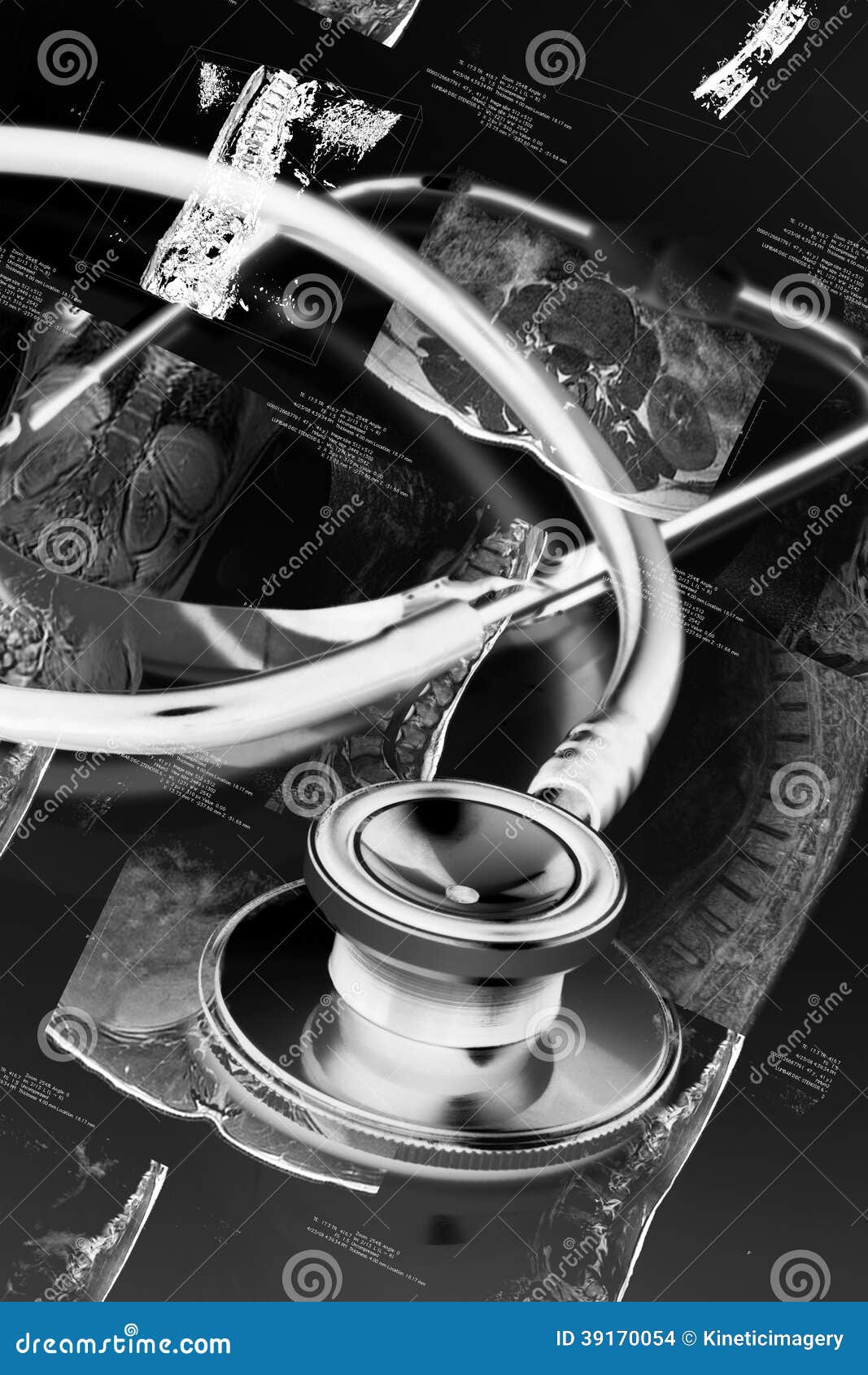 Xray MRI Images Showing Real Fracture Of Leg Bone Under The Knee After ...