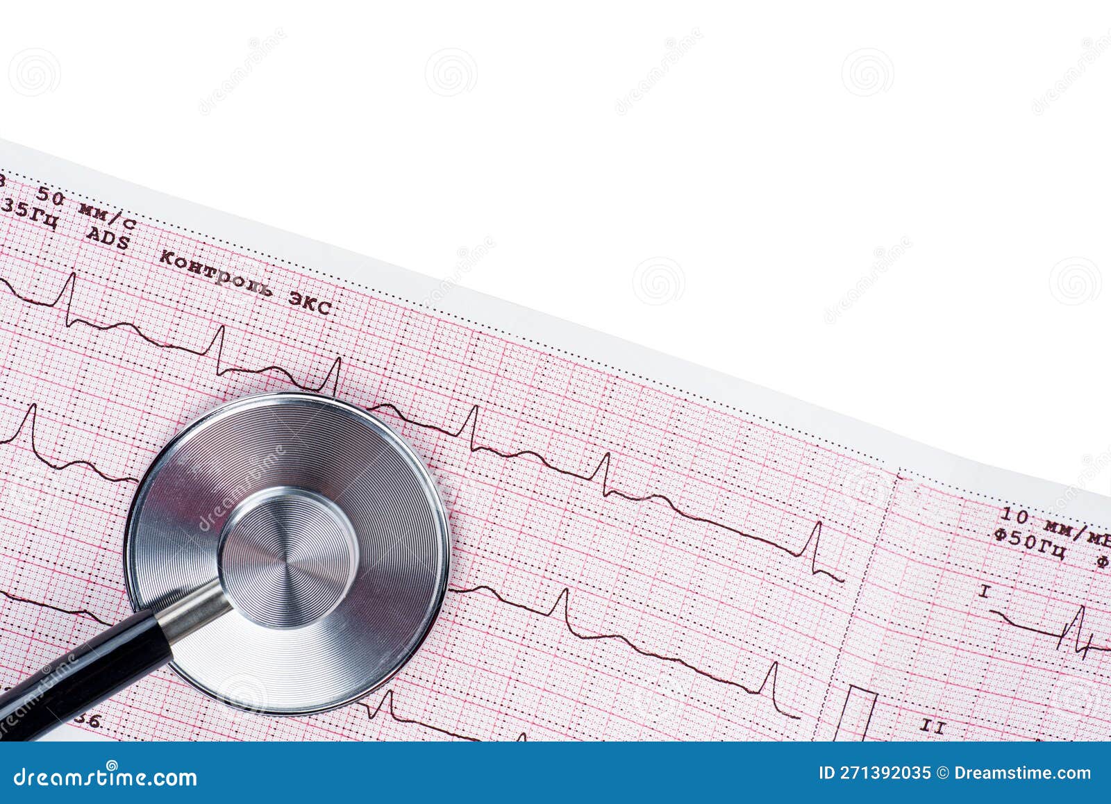 An Abnormal Electrocardiogram Result Paper With A Little Yellow Candy ...