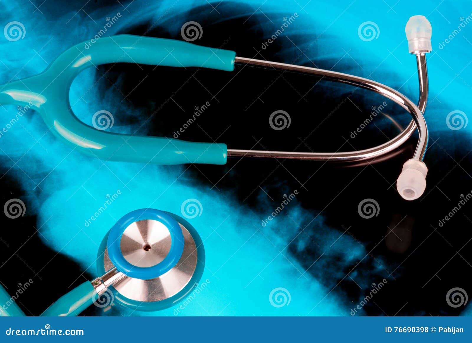 Stethoscope on a Xray stock photo. Image of cardiac, care - 76690398