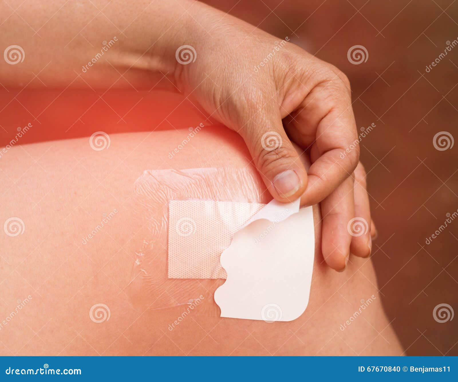 Sticking plaster leg. stock photo. Image of injury, bandage - 67670840