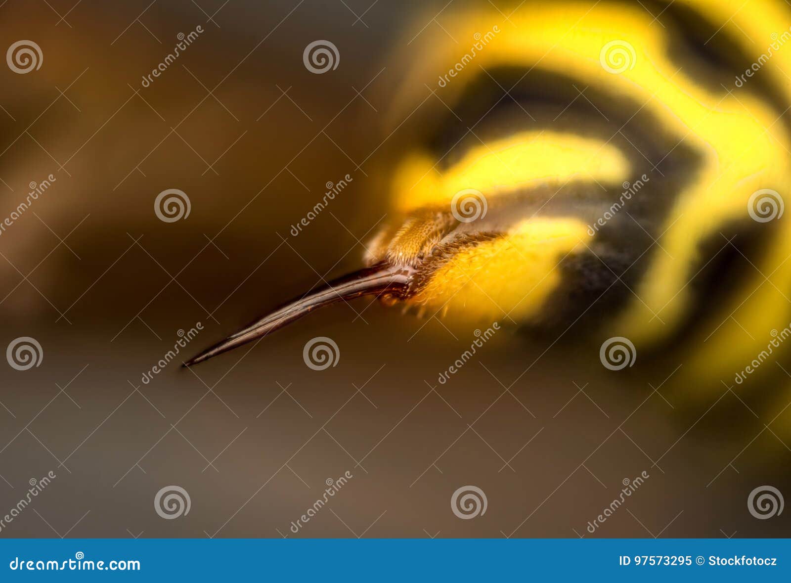 Wasp Sting Human. Close Up Detailed With Magnifier Pathogenesis Of Bee ...