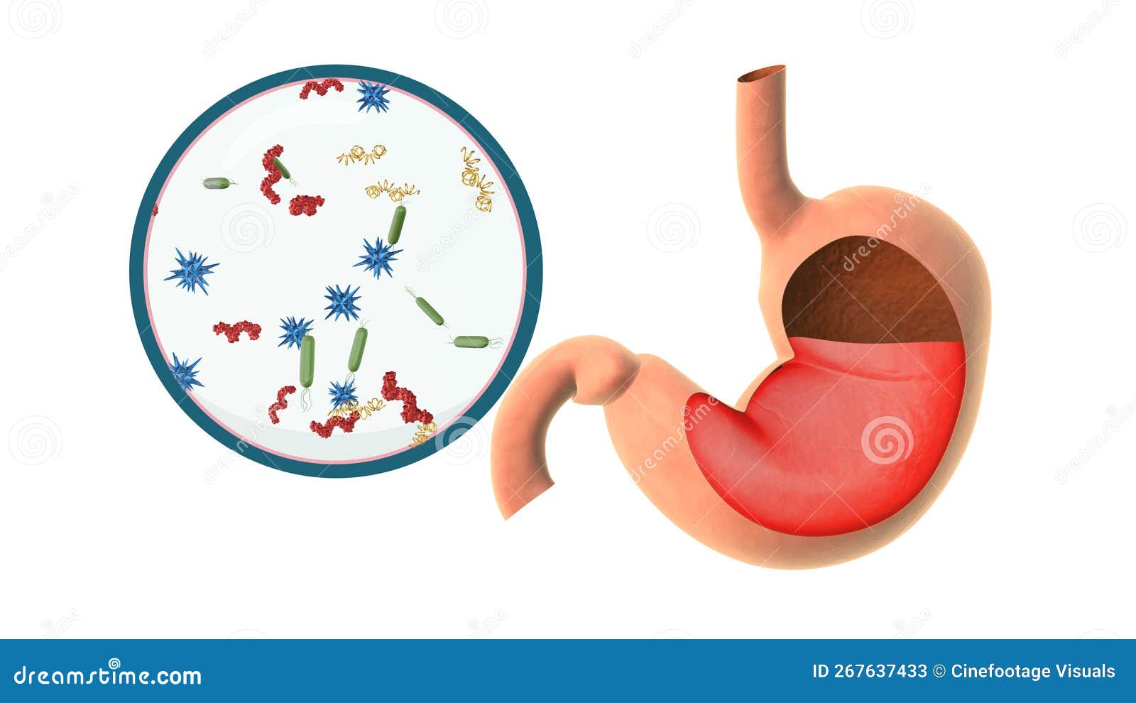 Human Stomach with Viruses and Bacteria Stock Illustration ...