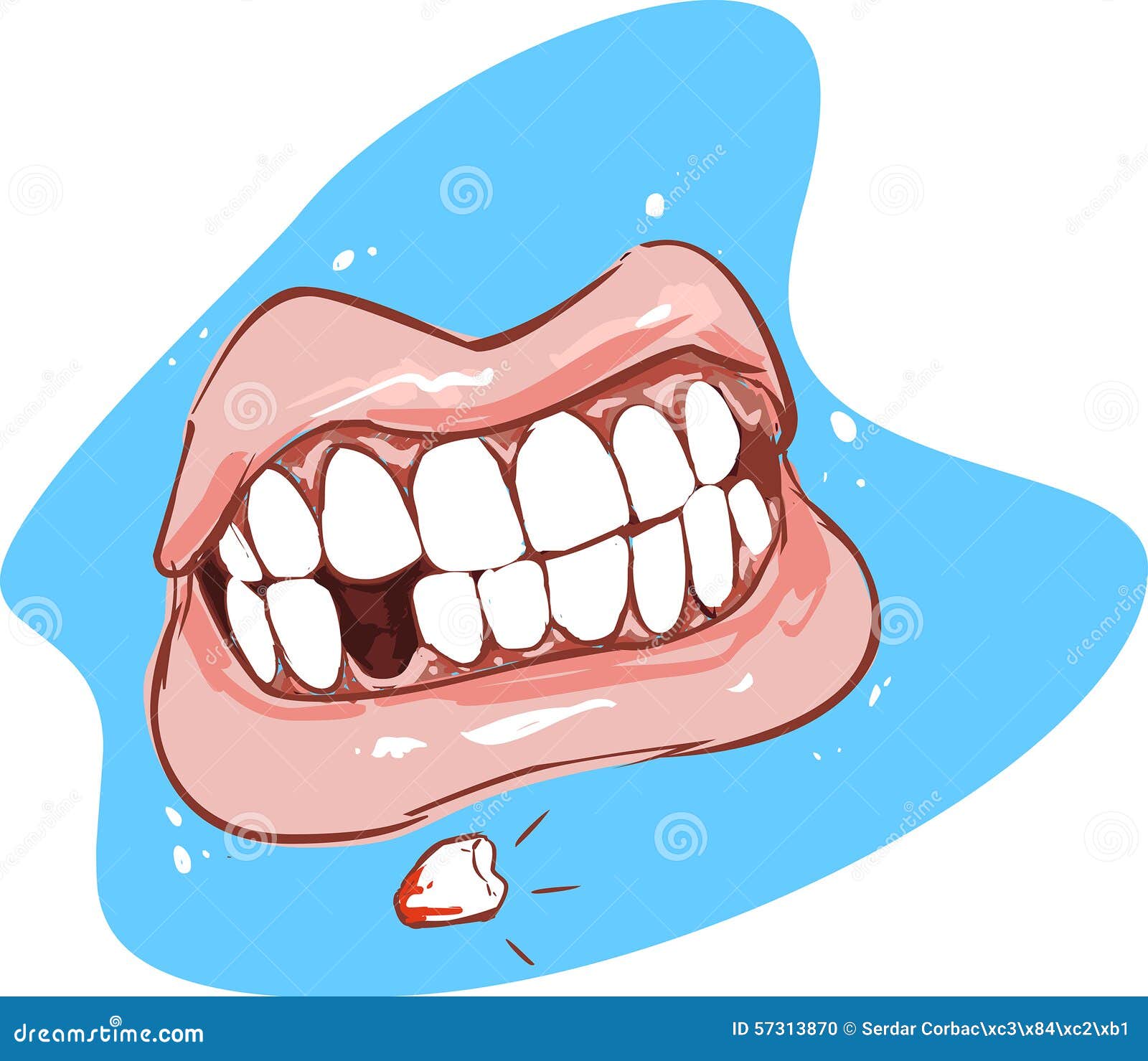 Stock vector broken teeth stock vector. Illustration of design - 57313870