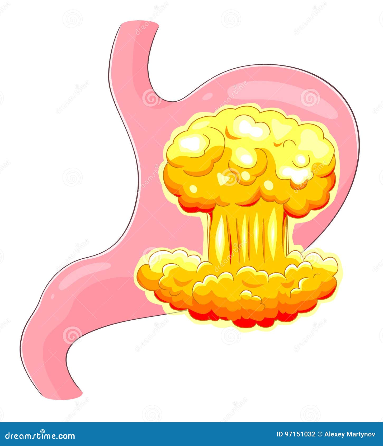 Stomach with an Atomic Explosion Stock Vector - Illustration of atomic ...