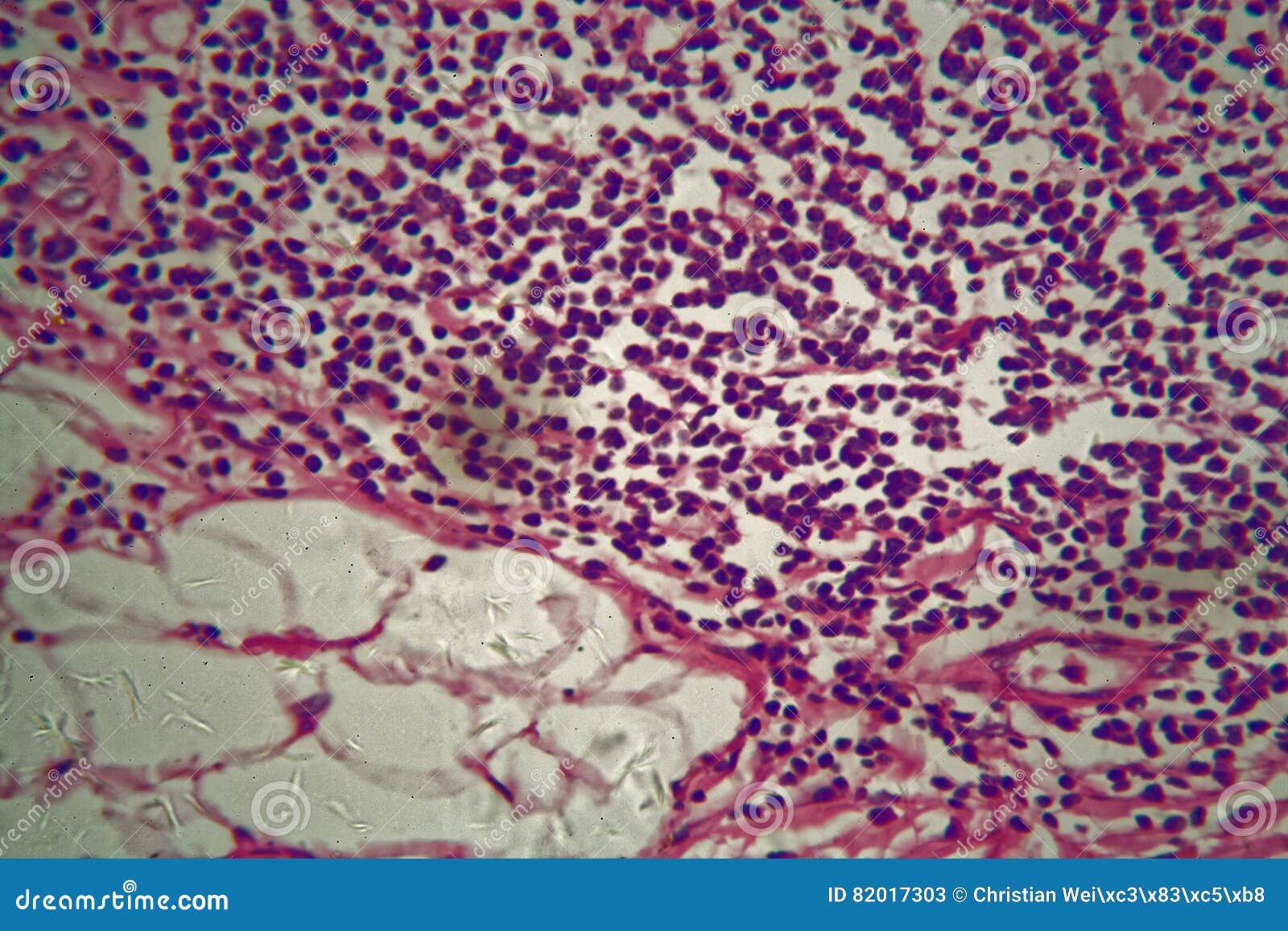 Stomach Wall Under A Microscope Royalty-Free Stock Photo ...