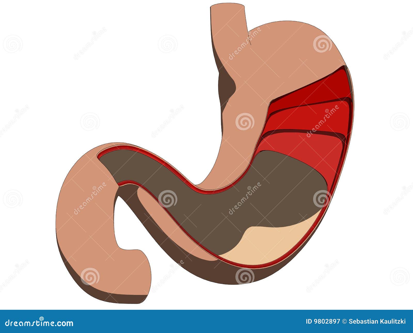 Stomach cross section stock vector. Illustration of ulcer - 9802897