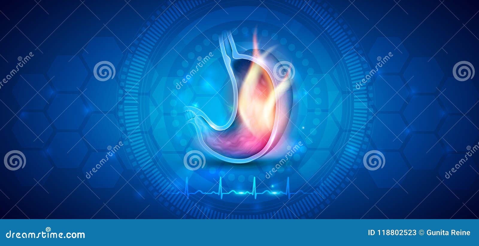 Strictures Cartoons, Illustrations & Vector Stock Images - 31 Pictures ...