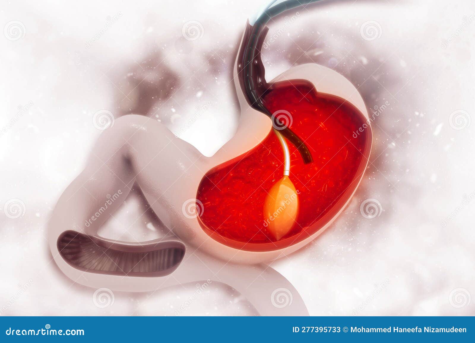 Stomach Endoscopy stock illustration. Illustration of light - 277395733