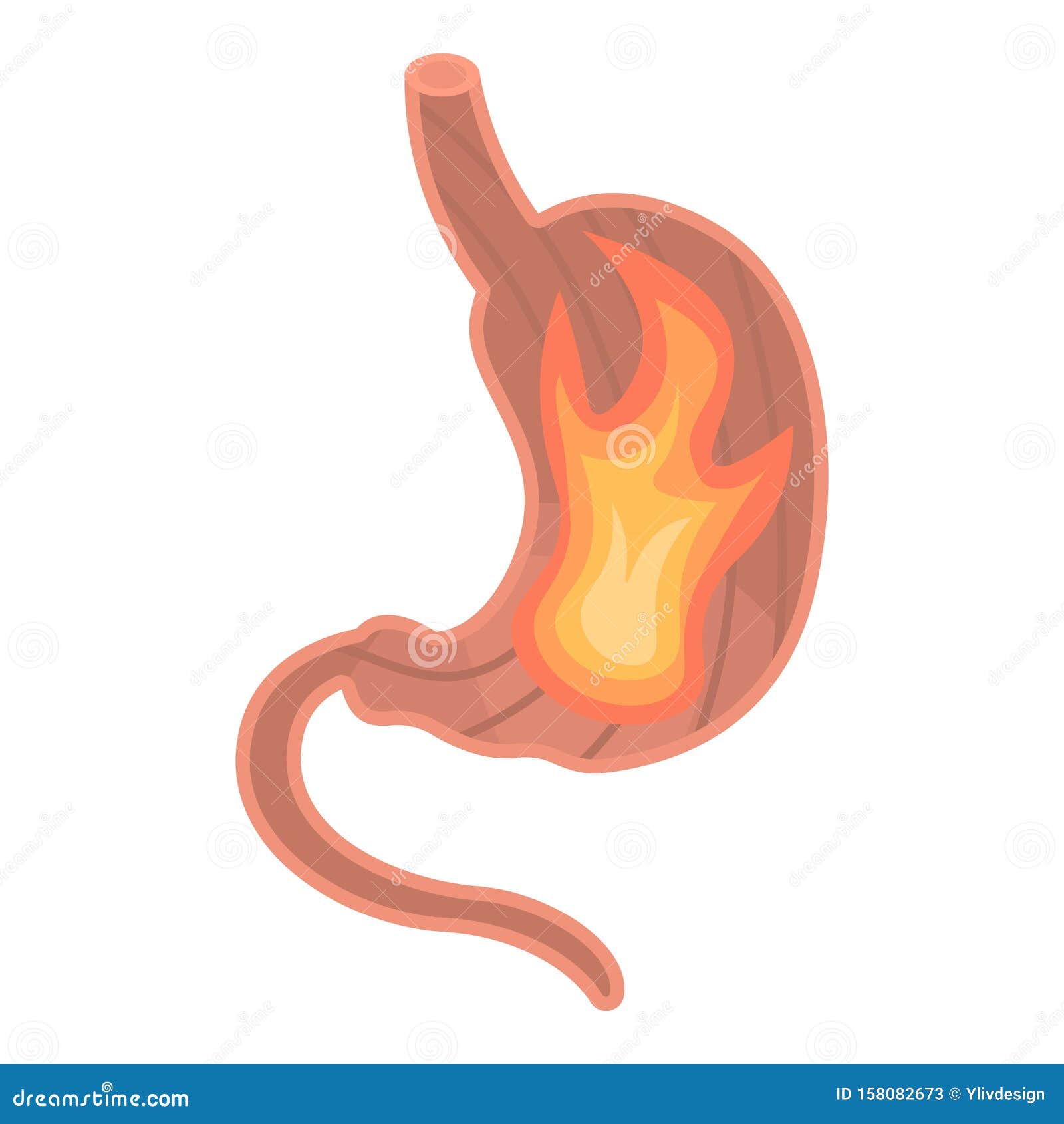 Stomach Fire. Excessive Acidity, Indigestion, Stomach Disease, Gastric ...