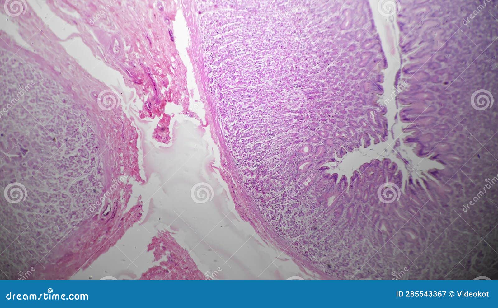 Stomach Fundic Portion in Section Filmed Under Microscope 100x on ...
