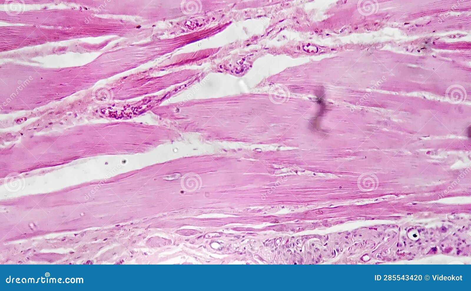 Stomach Fundic Portion in Section Filmed Under Microscope 200x on ...