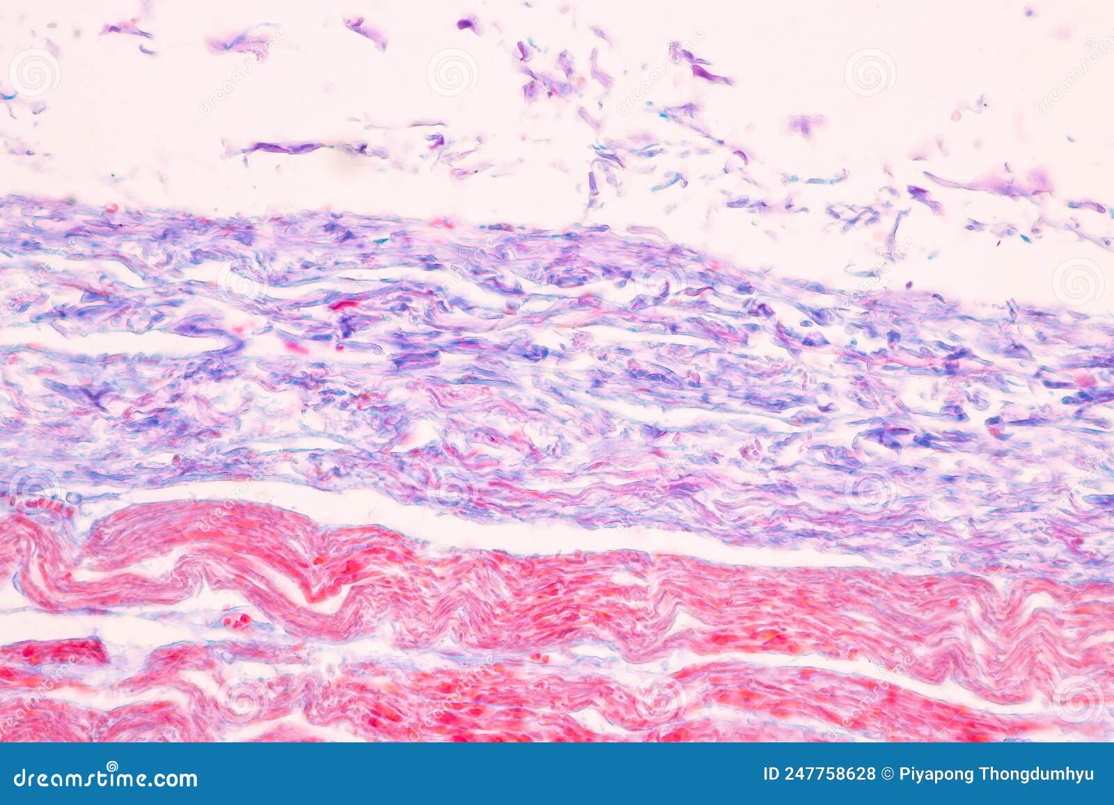 Tissue of Stomach Human Under the Microscope in Lab. Stock Photo ...