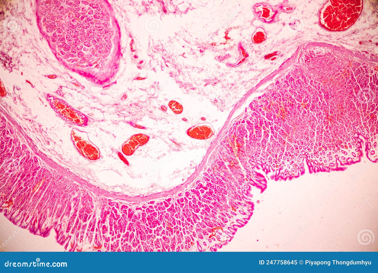 Tissue of Stomach Human Under the Microscope in Lab. Stock Image ...