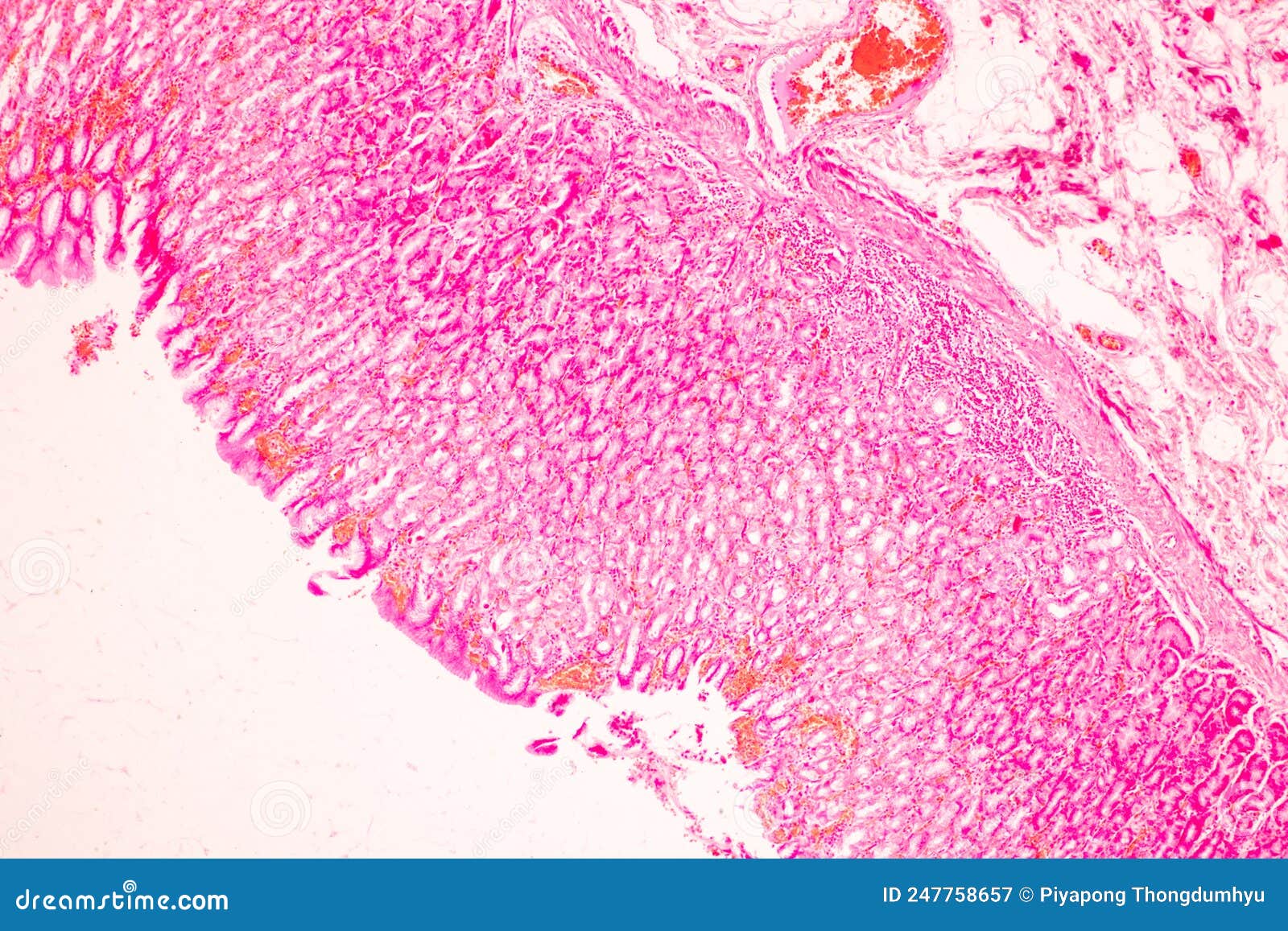 Tissue of Stomach Human Under the Microscope in Lab. Stock Image ...