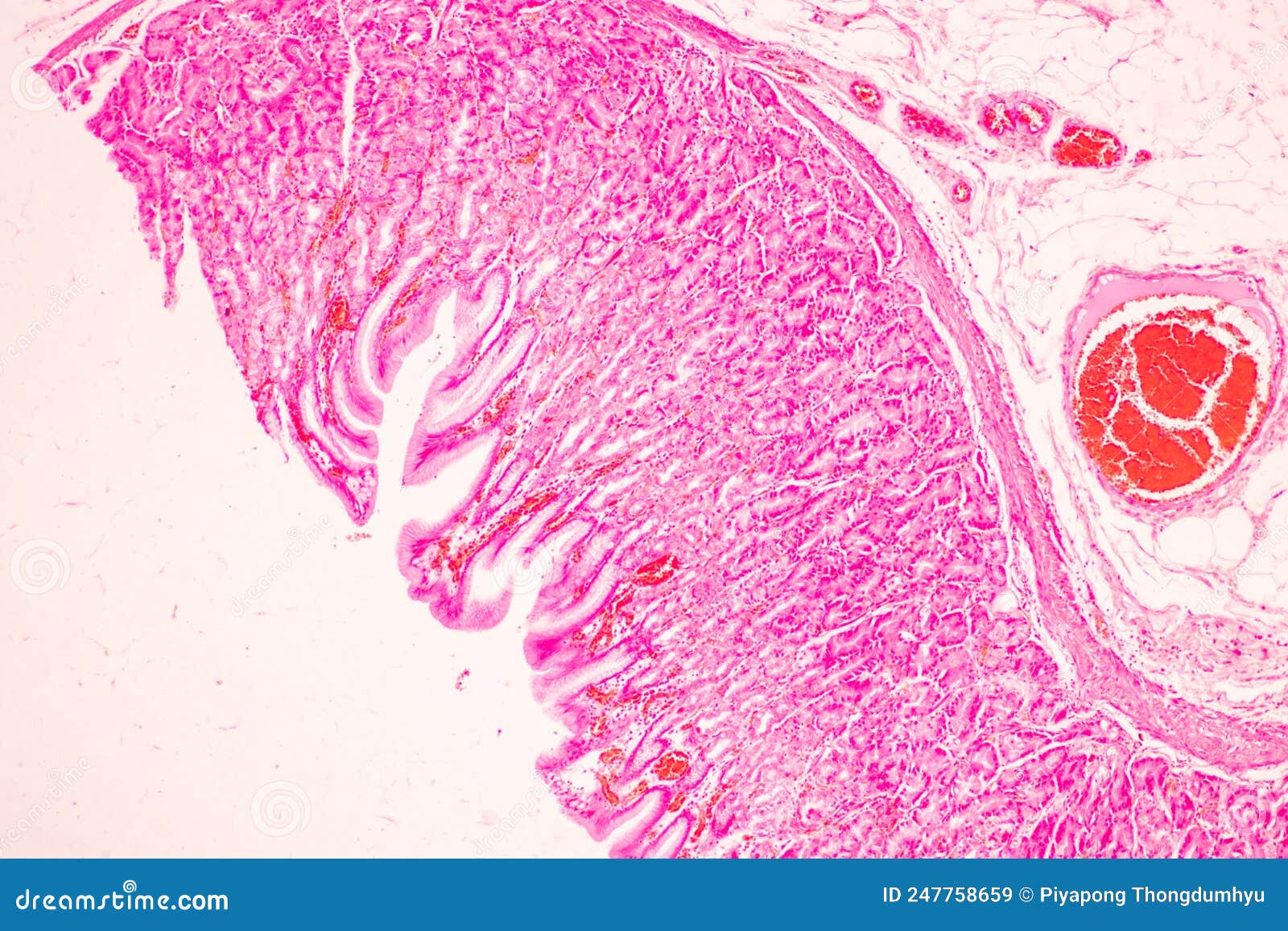 Tissue of Stomach Human Under the Microscope in Lab. Stock Image ...