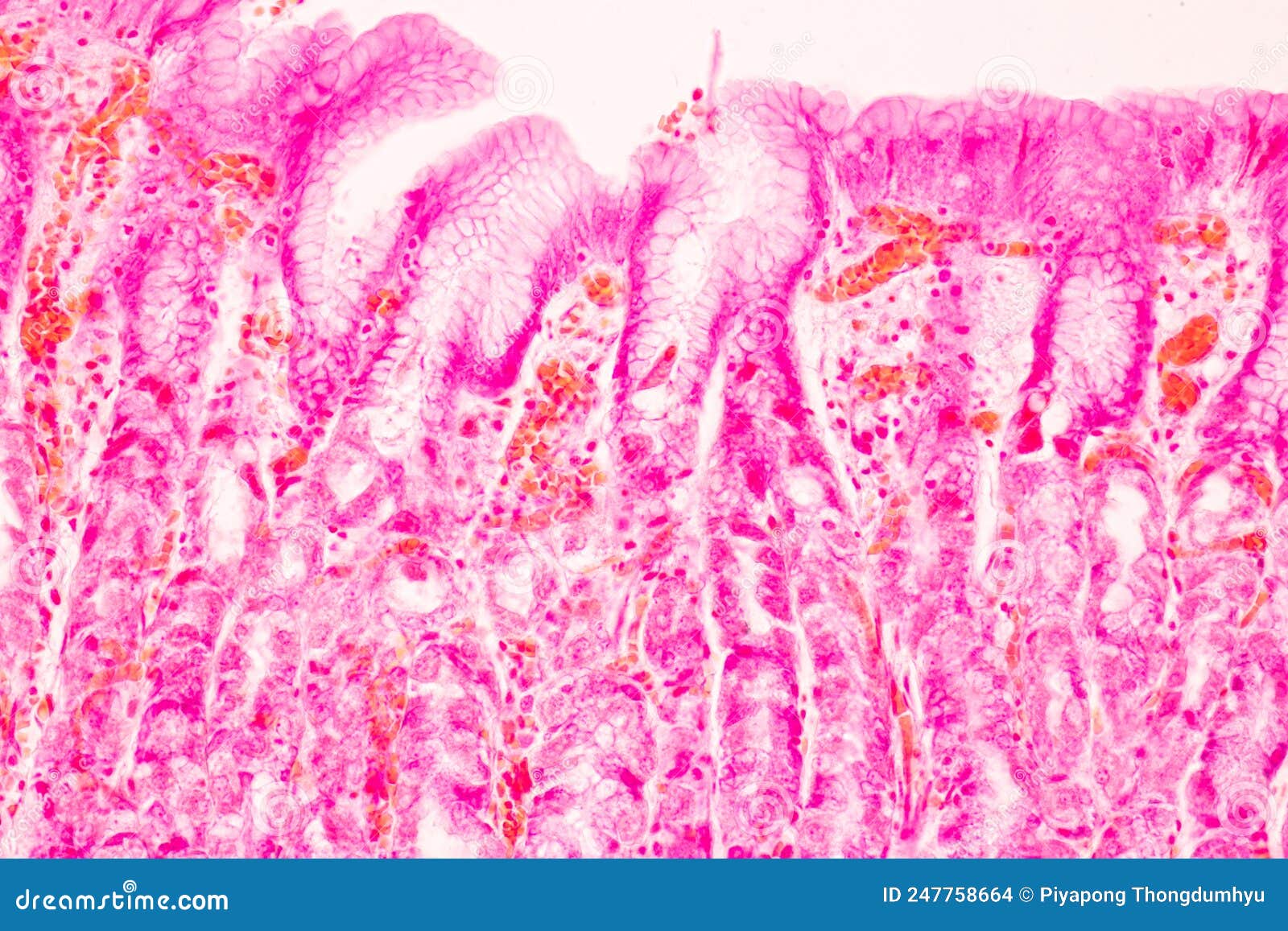 Tissue of Stomach Human Under the Microscope in Lab. Stock Photo ...