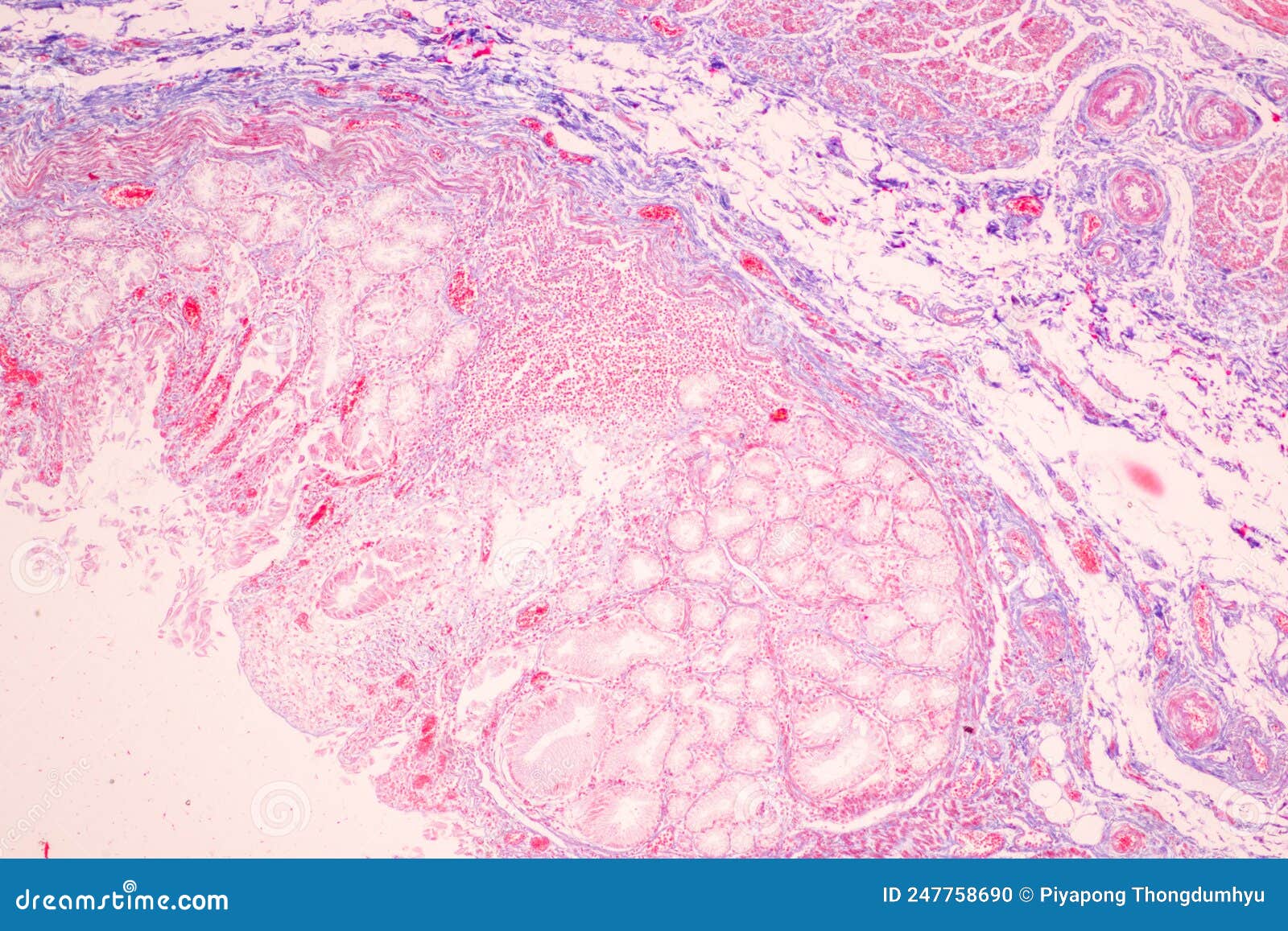 Tissue of Stomach Human Under the Microscope in Lab. Stock Photo ...