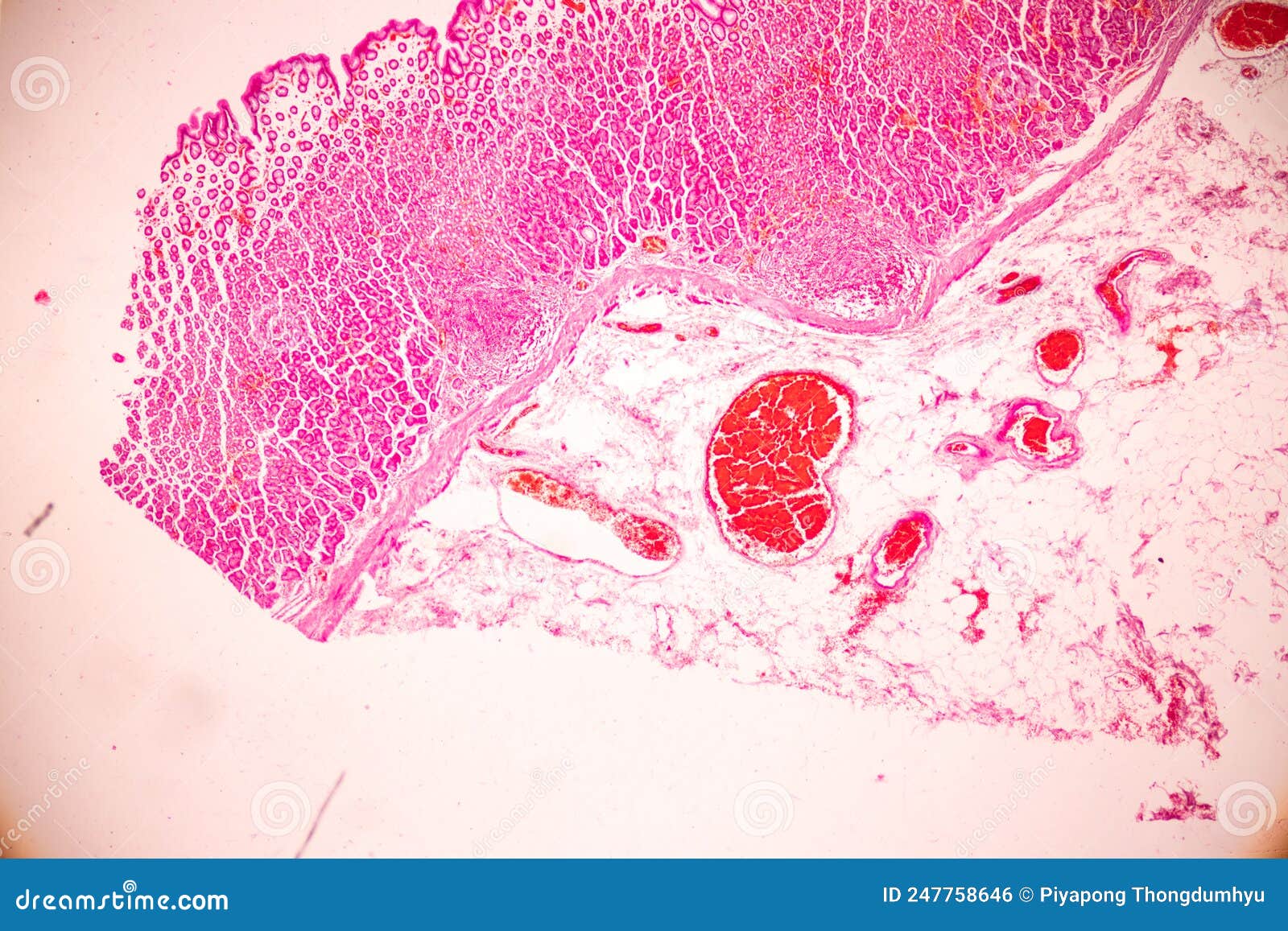 Tissue of Stomach Human Under the Microscope in Lab. Stock Photo ...