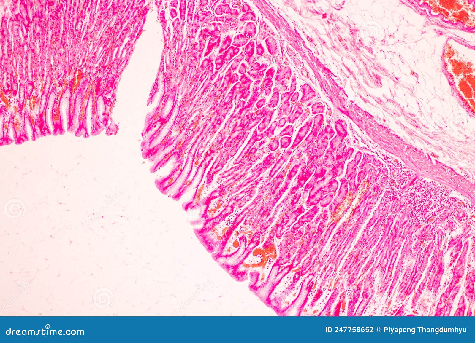 Tissue of Stomach Human Under the Microscope in Lab. Stock Photo ...