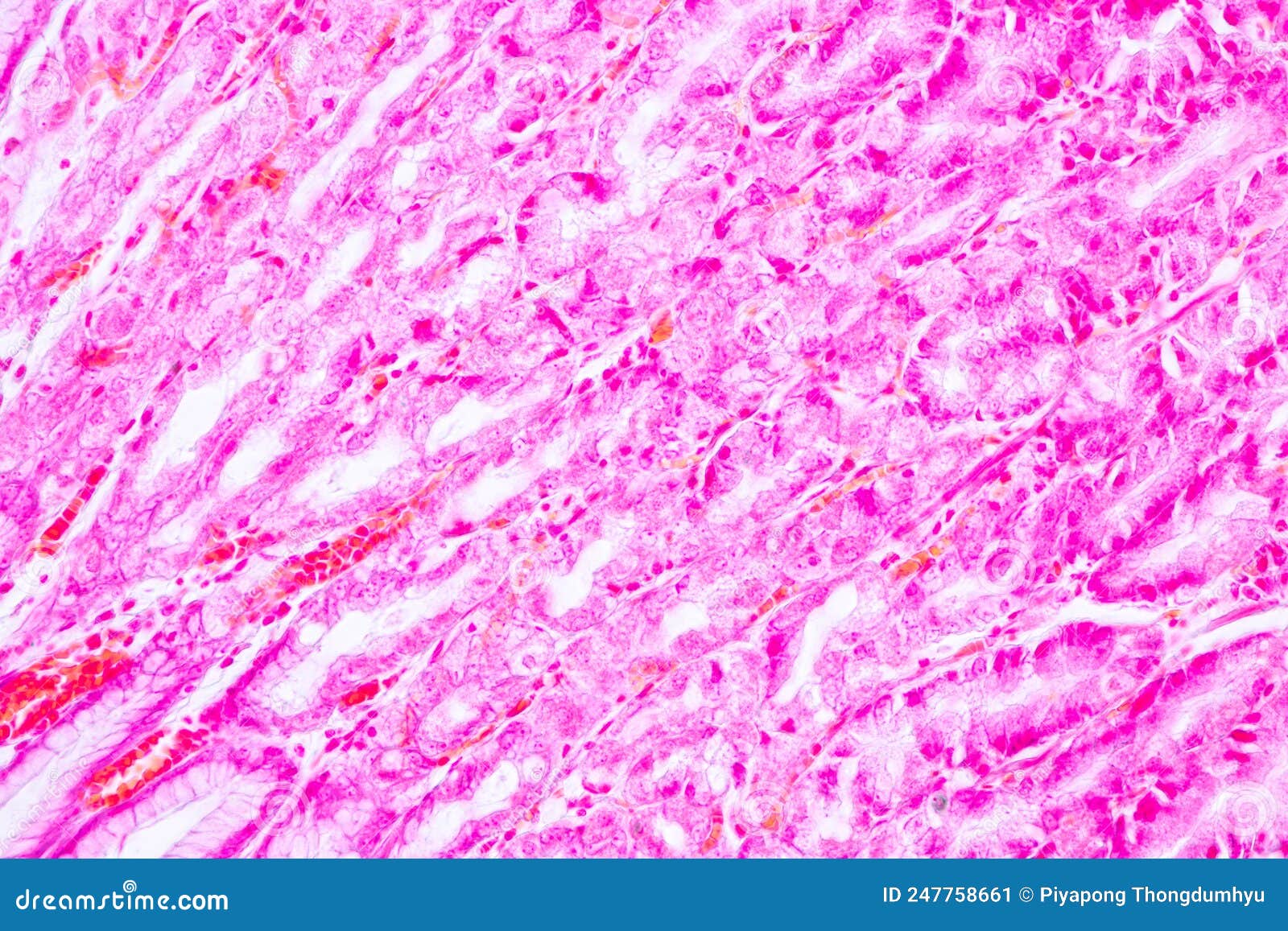 Tissue of Stomach Human Under the Microscope in Lab. Stock Image ...