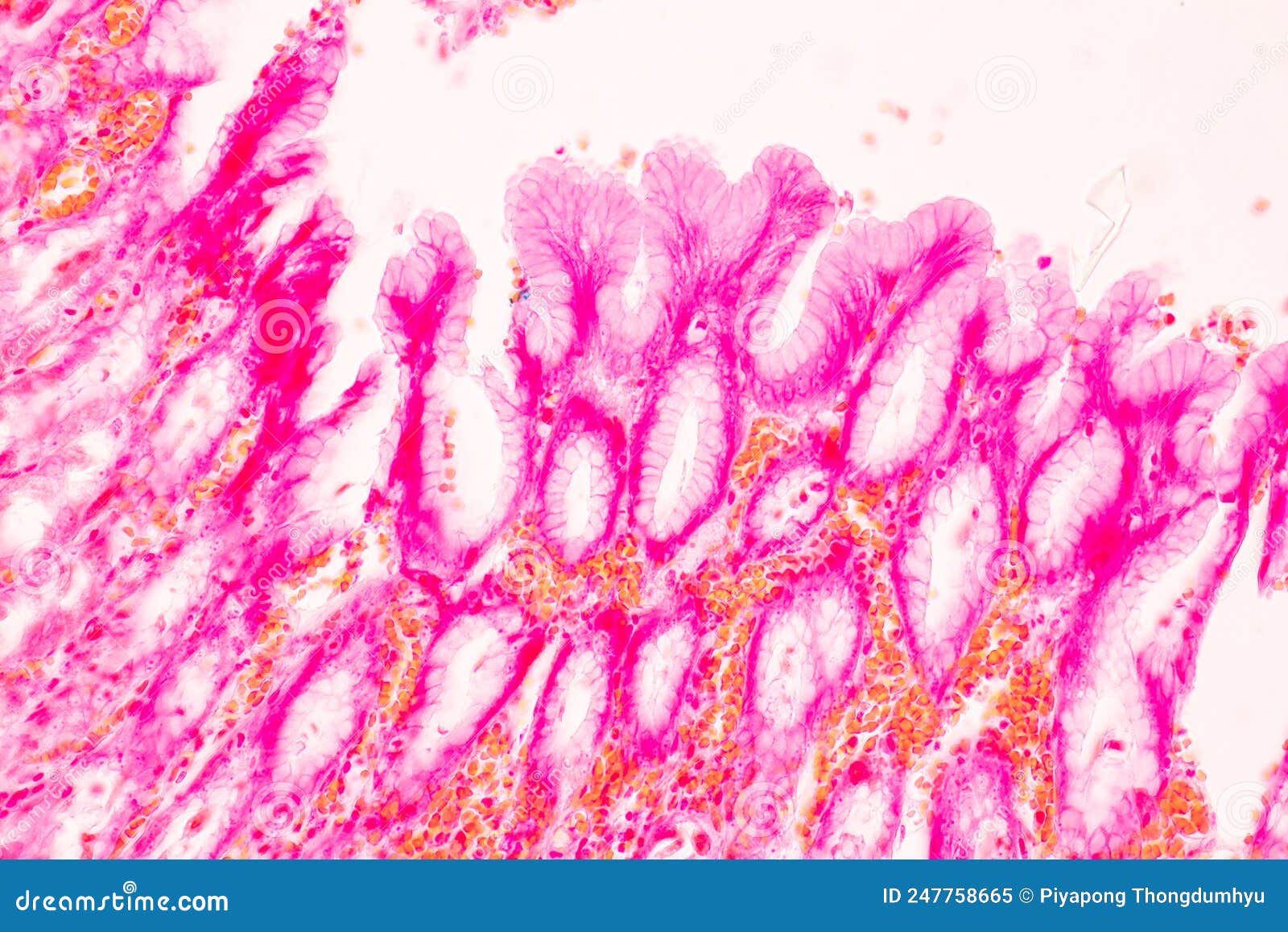 Tissue of Stomach Human Under the Microscope in Lab. Stock Image ...