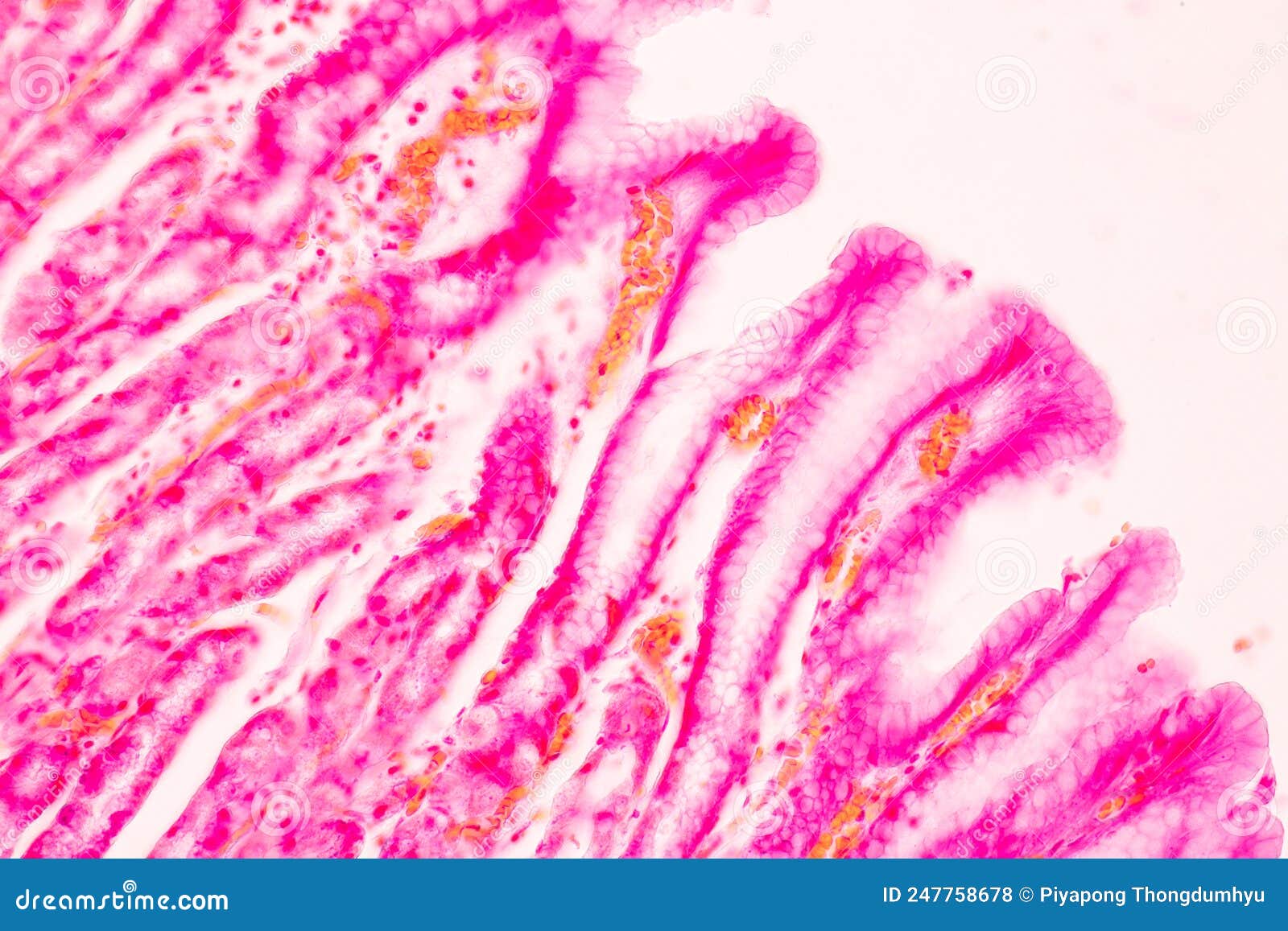 Tissue of Stomach Human Under the Microscope in Lab. Stock Photo ...