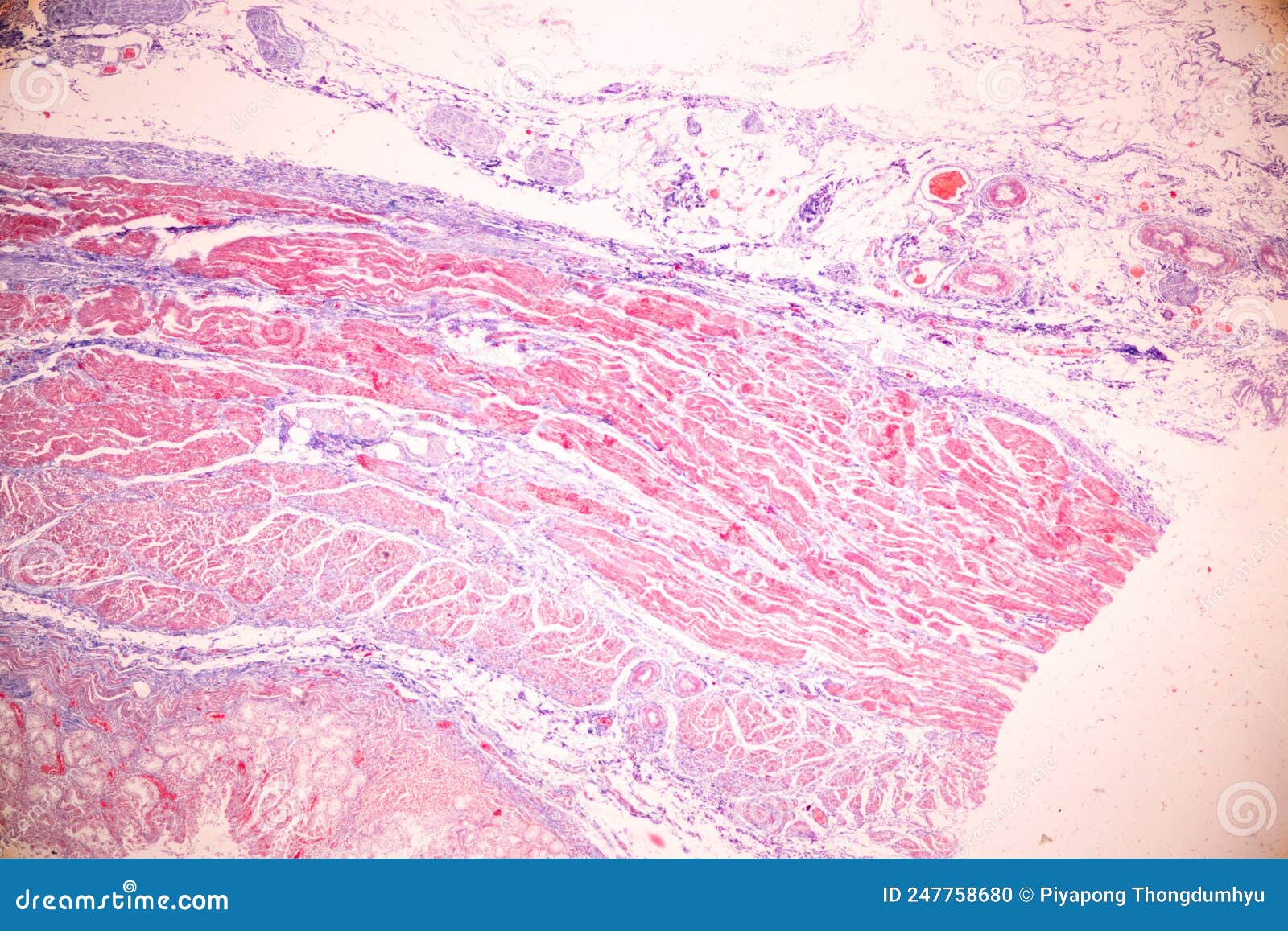 Tissue of Stomach Human Under the Microscope in Lab. Stock Photo ...
