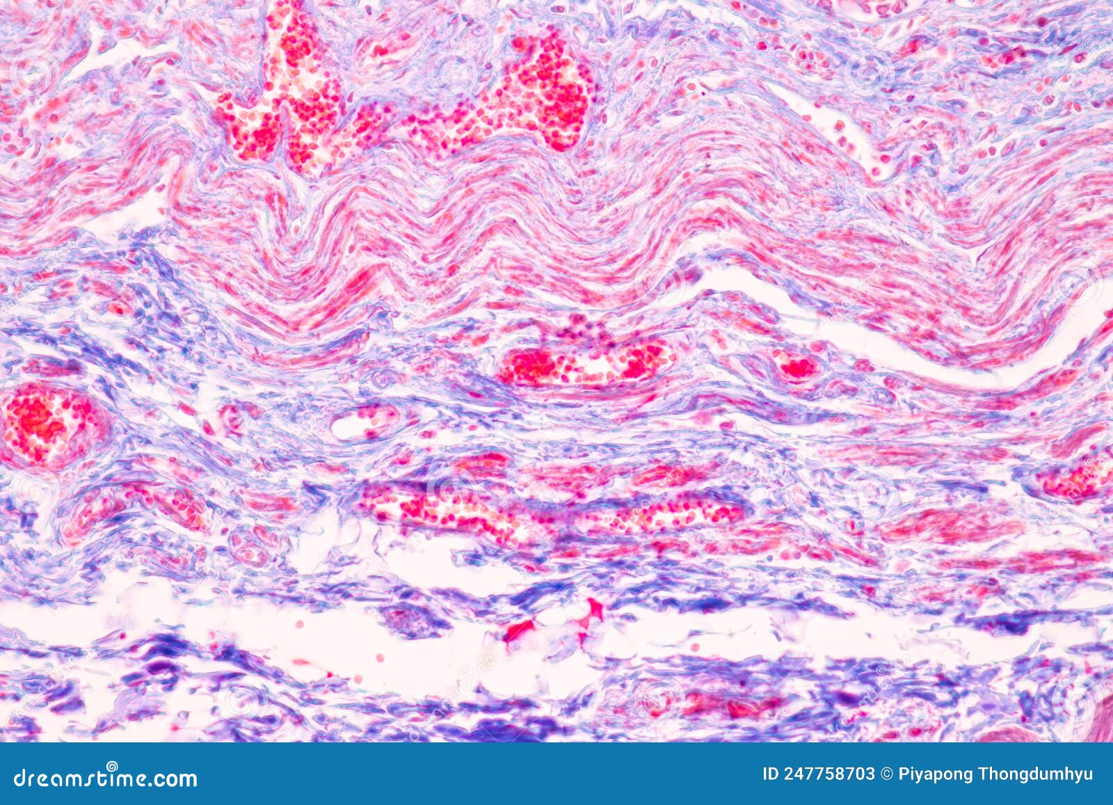 Tissue of Stomach Human Under the Microscope in Lab. Stock Image ...