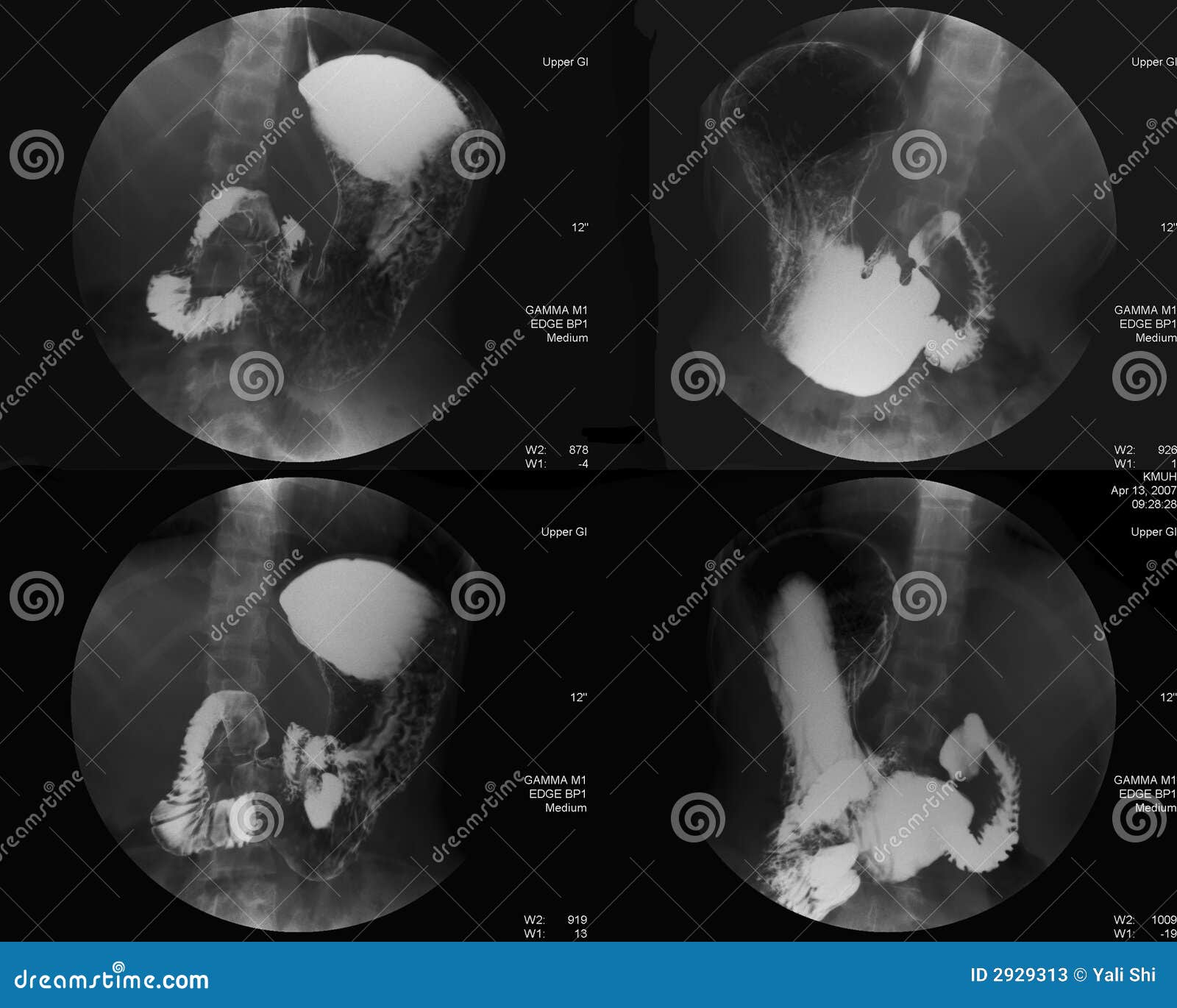 Stomach Radiology stock image. Image of medical, medicine - 2929313