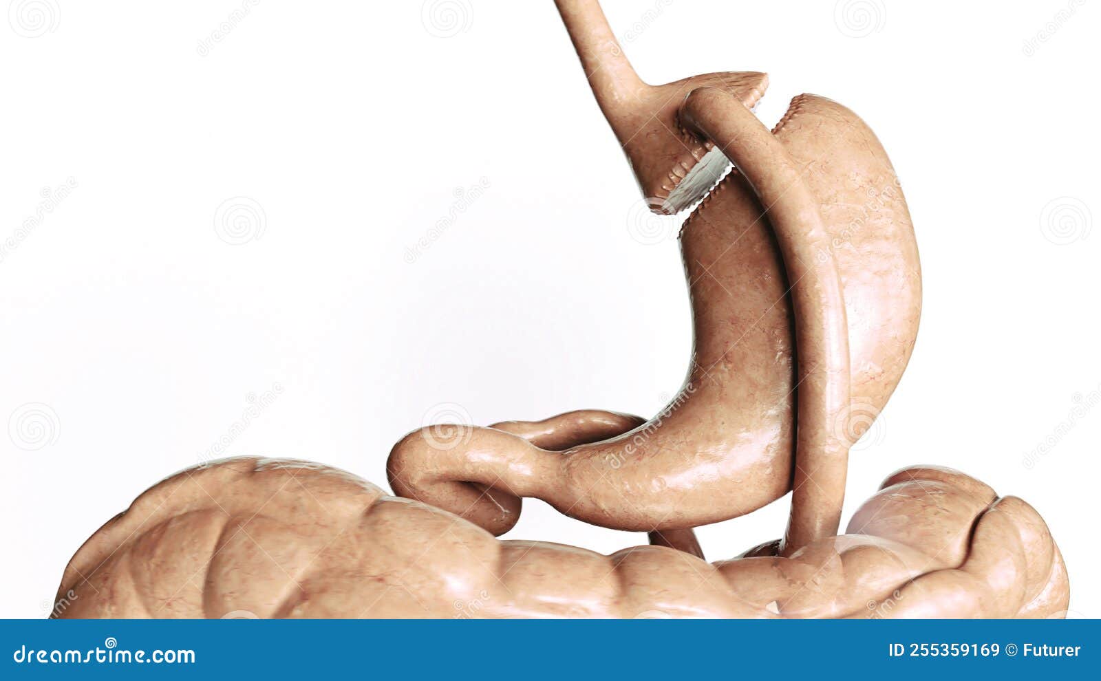 Stomach Reduction 2 of 4- Roux En Y Gastric Bypass - 3D Rendering Stock ...