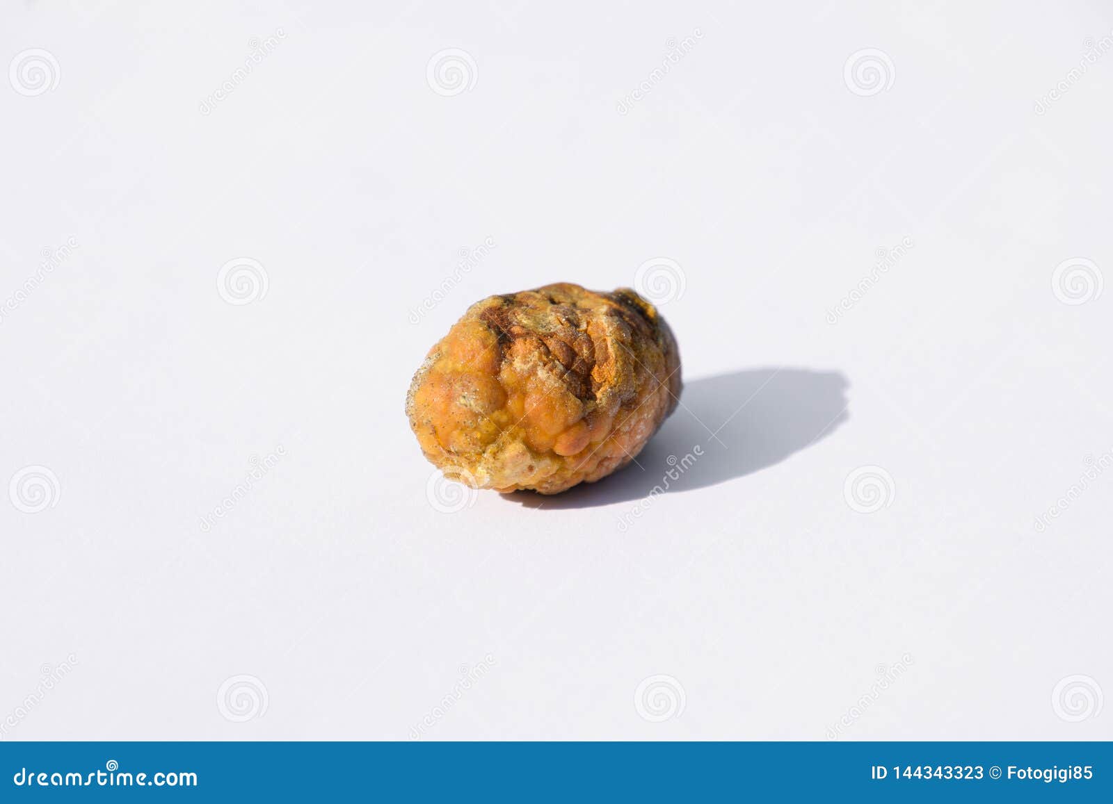 Stone of Gallbladder. the Result of Gallstones. a Calculus of ...