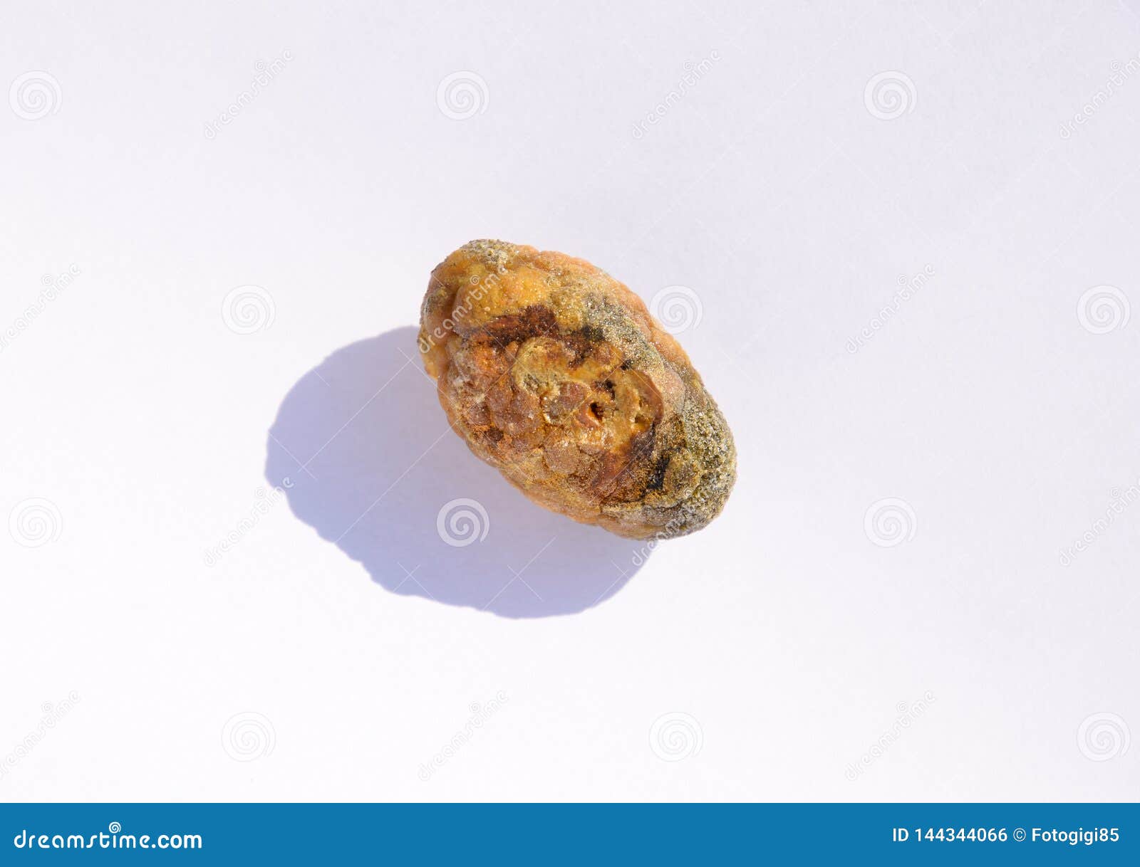 Stone of Gallbladder. the Result of Gallstones. a Calculus of ...