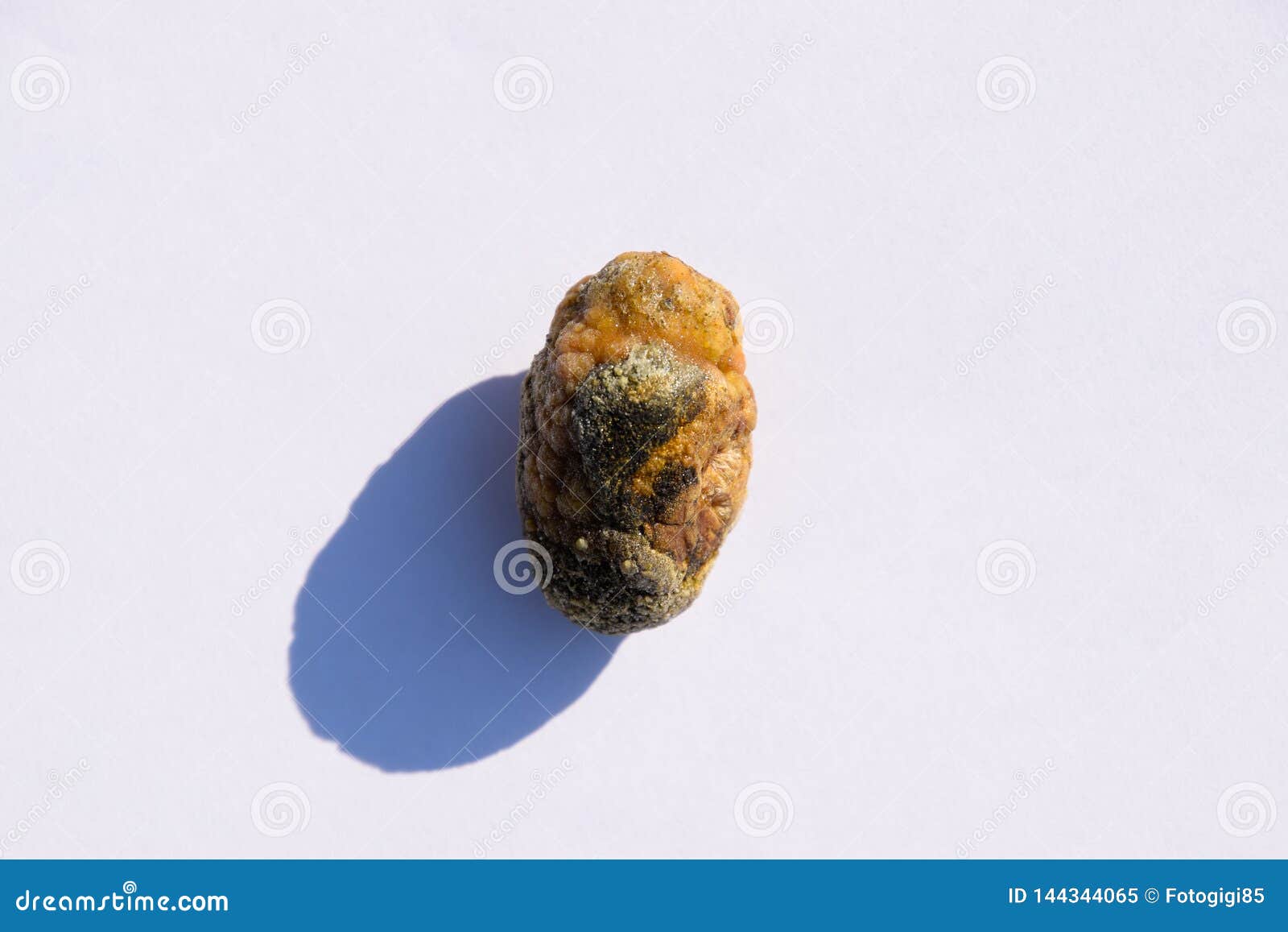 Stone of Gallbladder. the Result of Gallstones. a Calculus of ...
