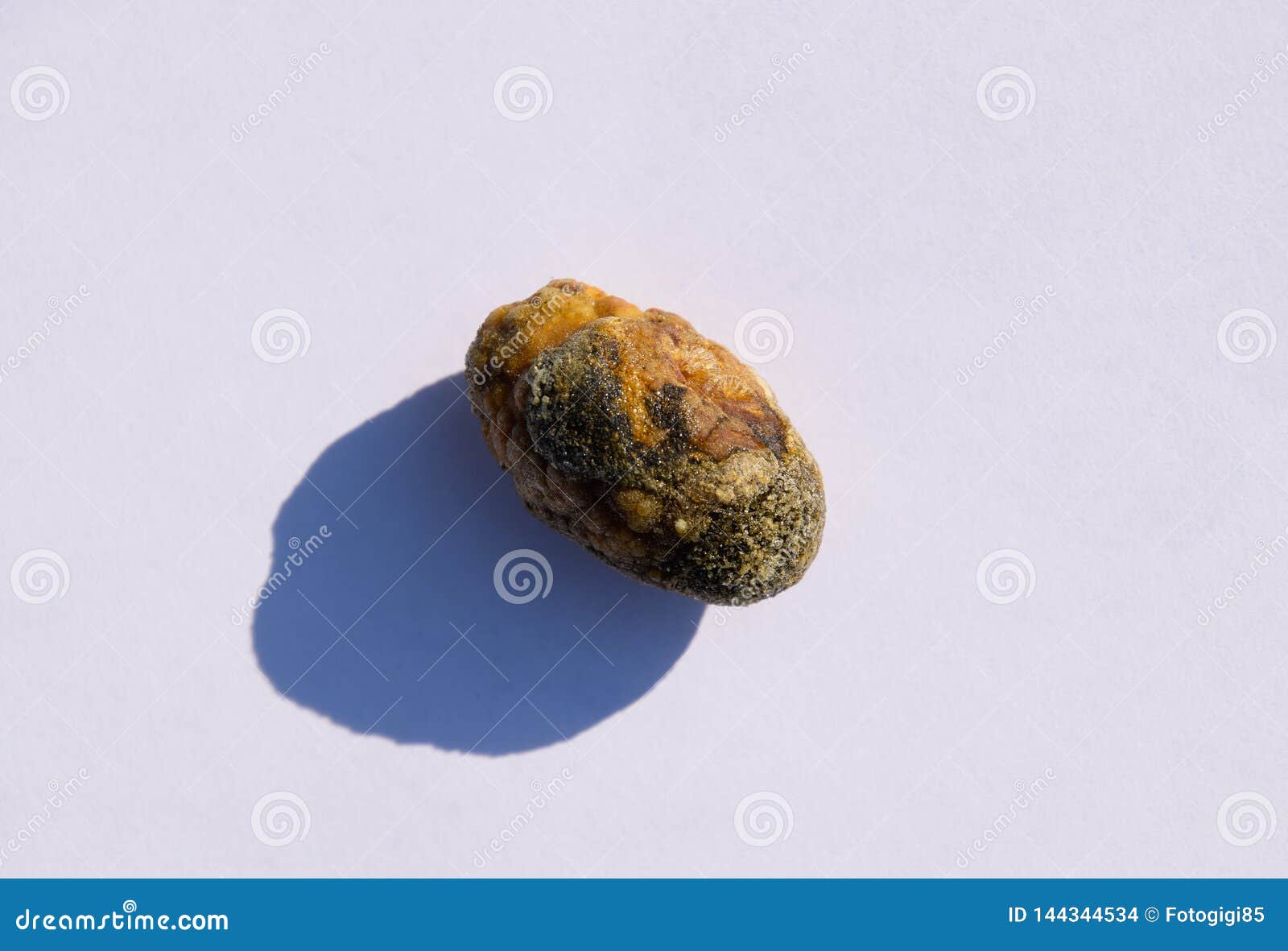 Stone of Gallbladder. the Result of Gallstones. a Calculus of ...