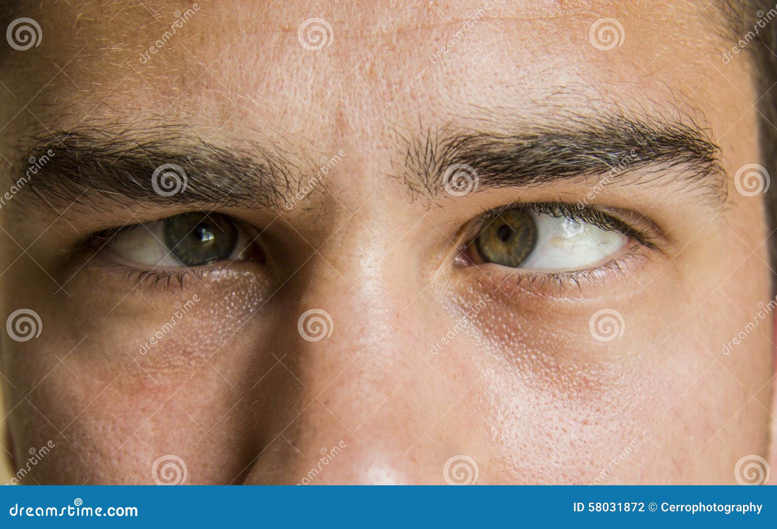 Strabismo degli occhi fotografia stock. Immagine di occhi - 58031872