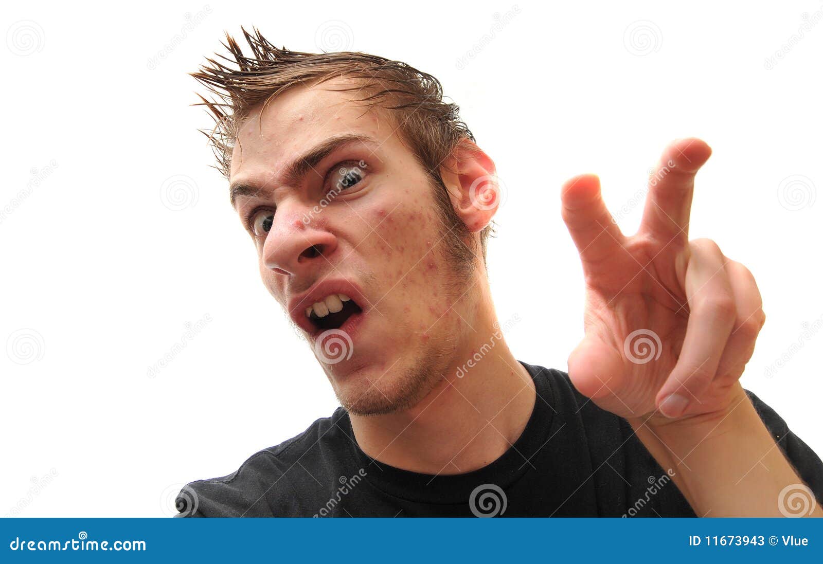 Strange Teenager with Weird Hair and Acne Stock Image - Image of ... Strange Teenager with Weird Hair and Acne Stock Image - Image of ...