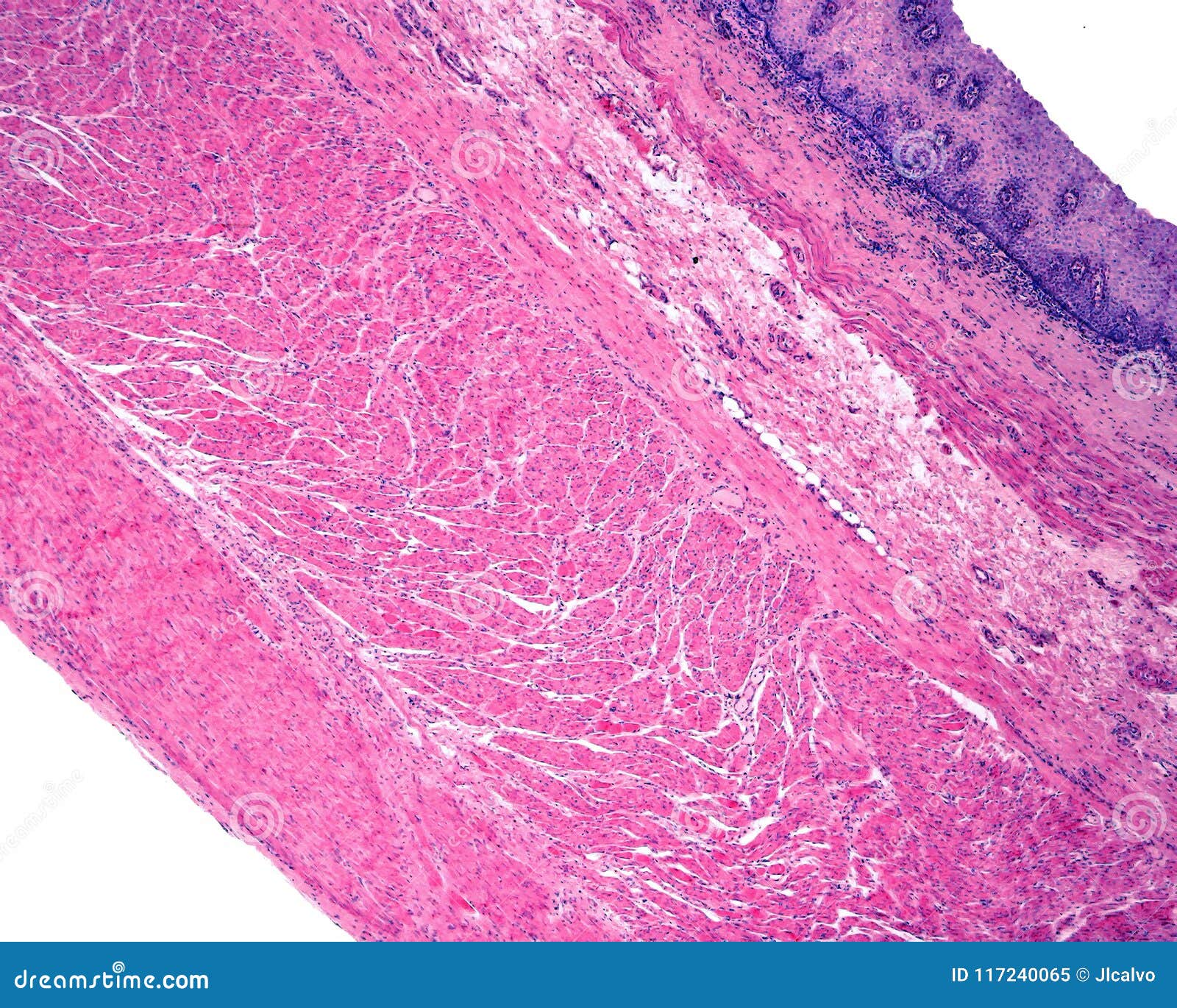 Strati dell'esofago immagine stock. Immagine di gastrointestinale ...