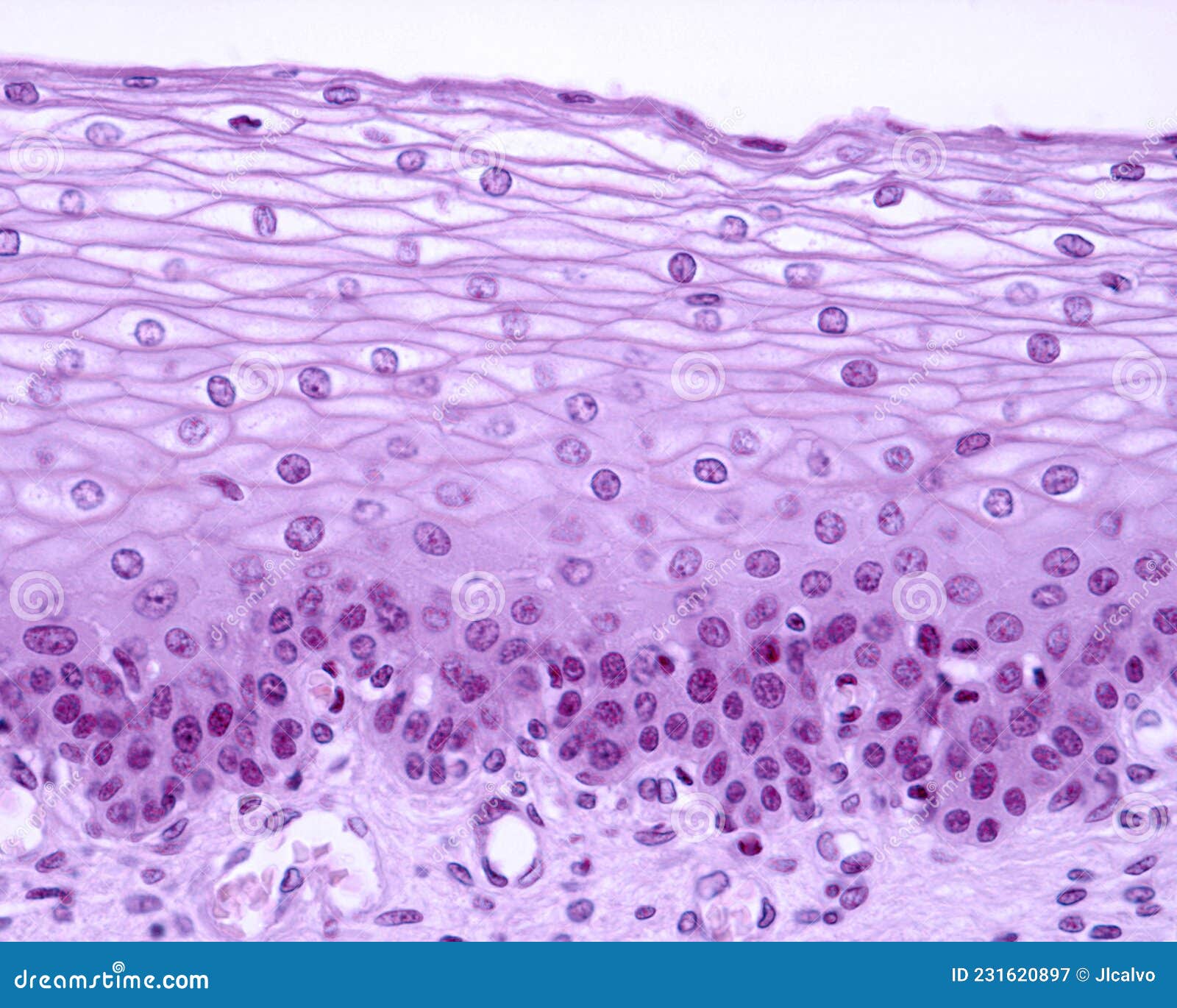 Stratified Squamous Keratinized Epithelium Labeled