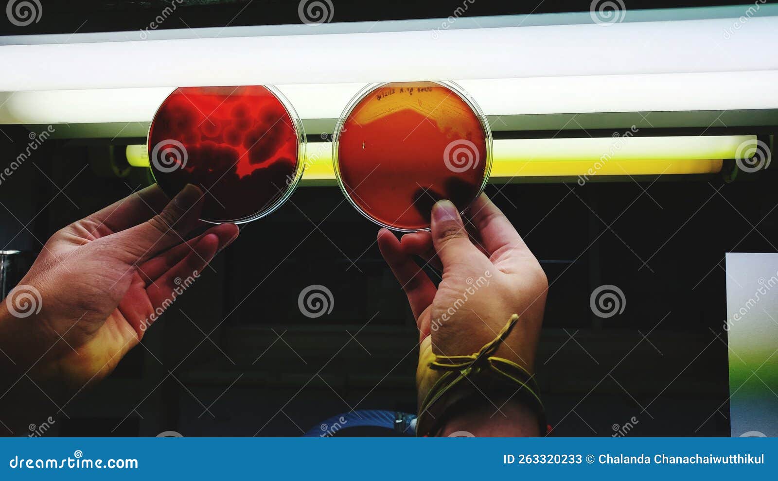 Streak plate Technique stock image. Image of technique - 263320233