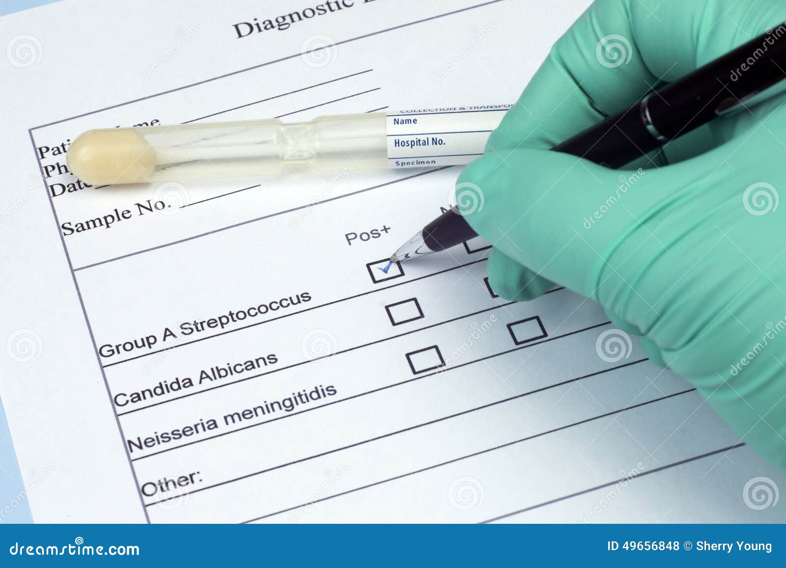 Strep Culture Test stock photo. Image of cells, healthcare - 49656848