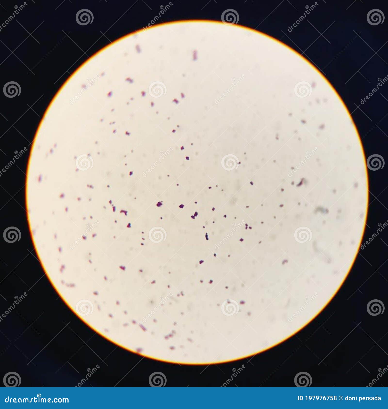 Strep pneumoniae stock photo. Image of tonsillitis, bacterial - 197976758